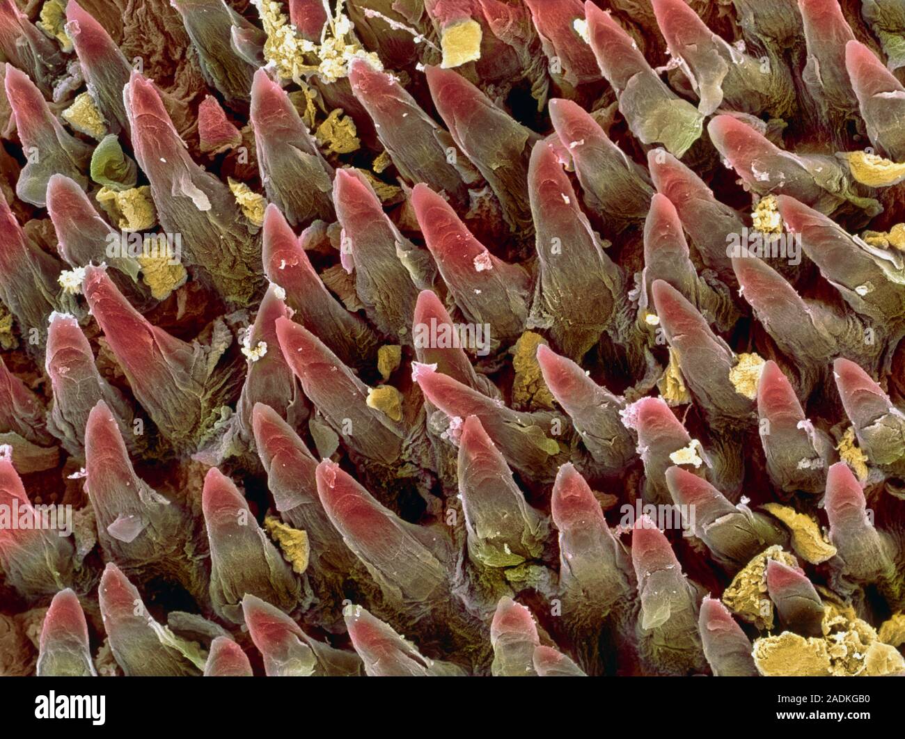 Tongue papillae. Coloured scanning electron micrograph (SEM) of ...