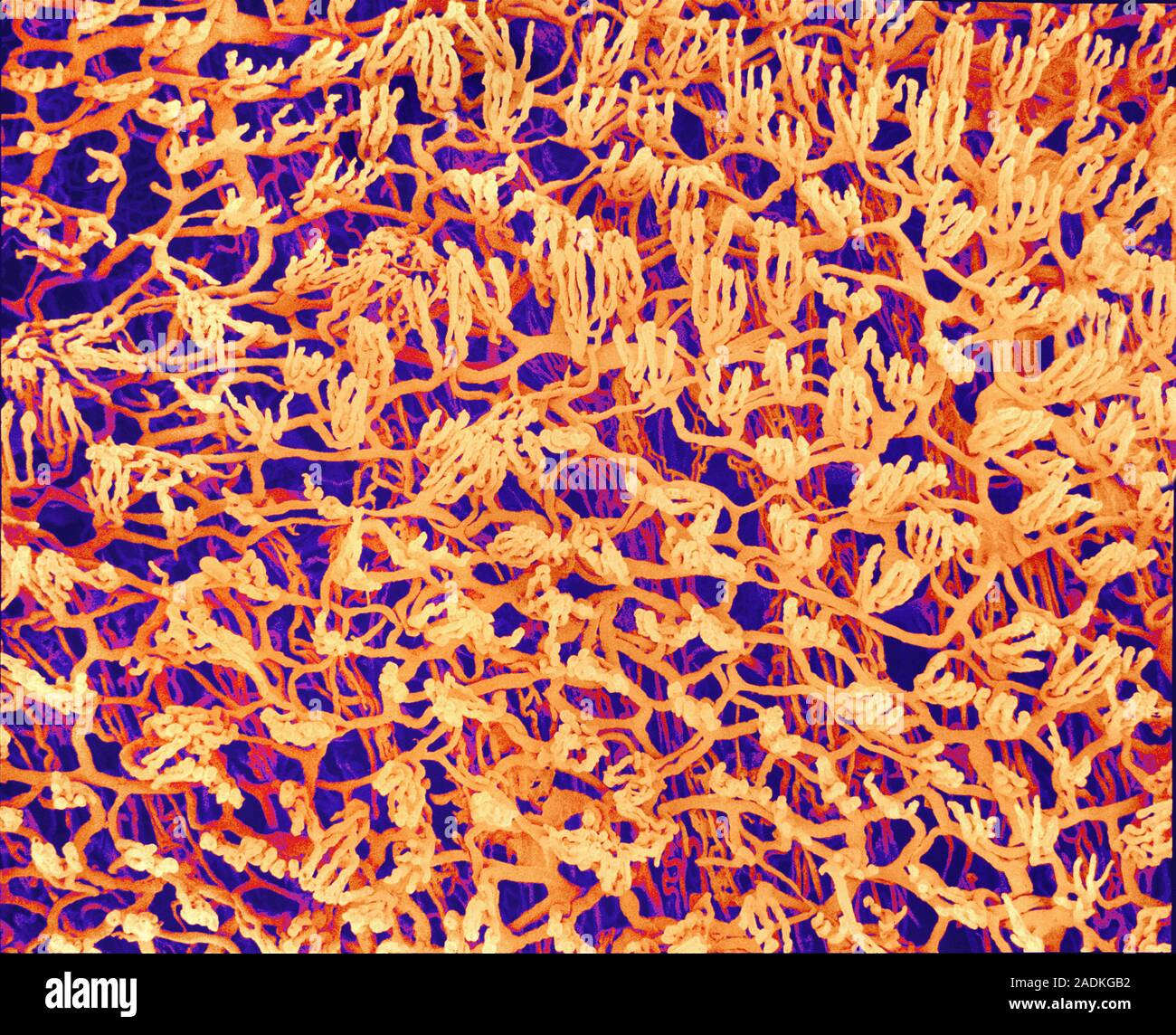 Tongue blood vessels. Coloured scanning electron micrograph (SEM) of a ...