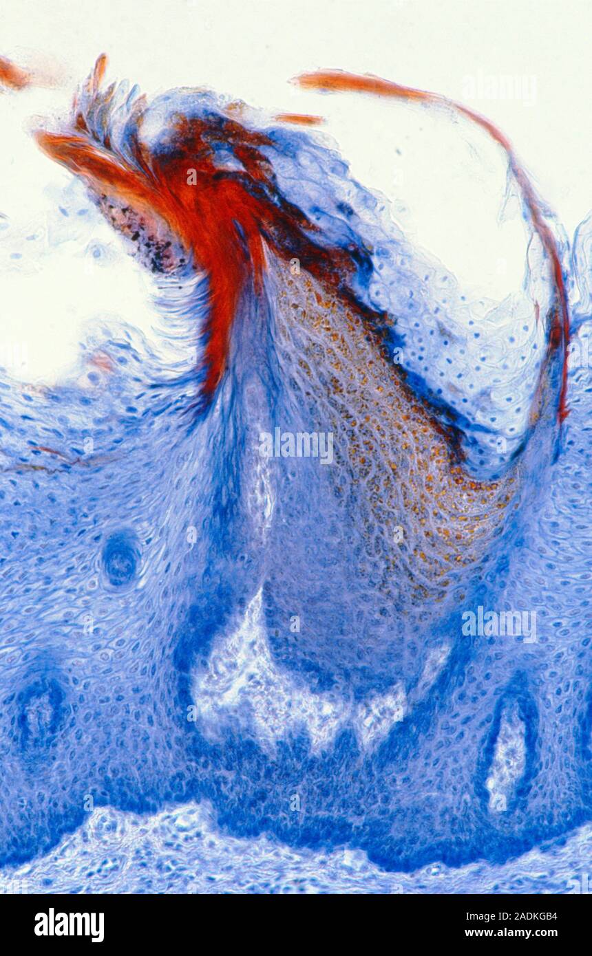 Tongue papilla. Light micrograph of a longitudinal section through a ...