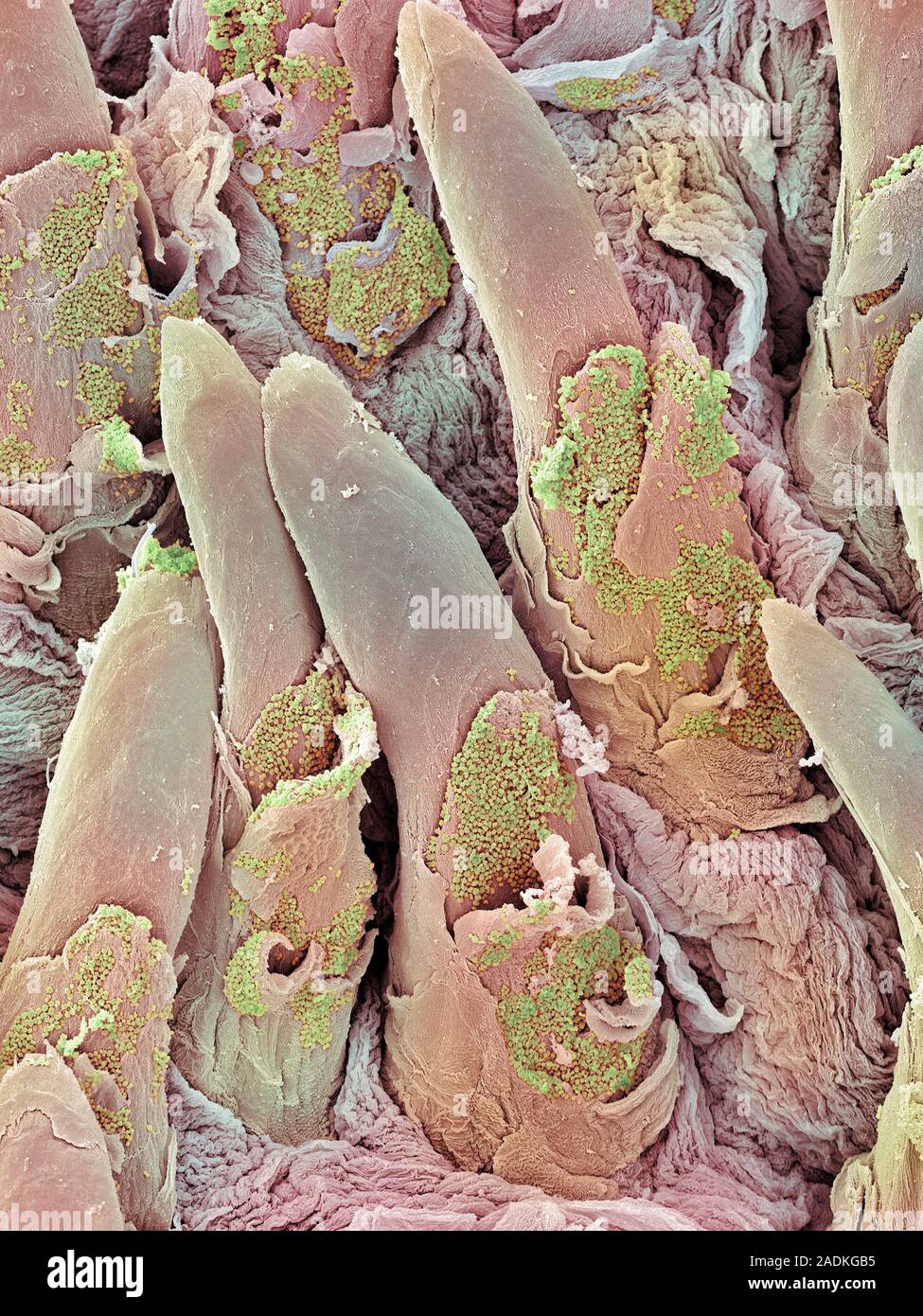 Tongue papillae. Coloured scanning electron micrograph (SEM) of ...