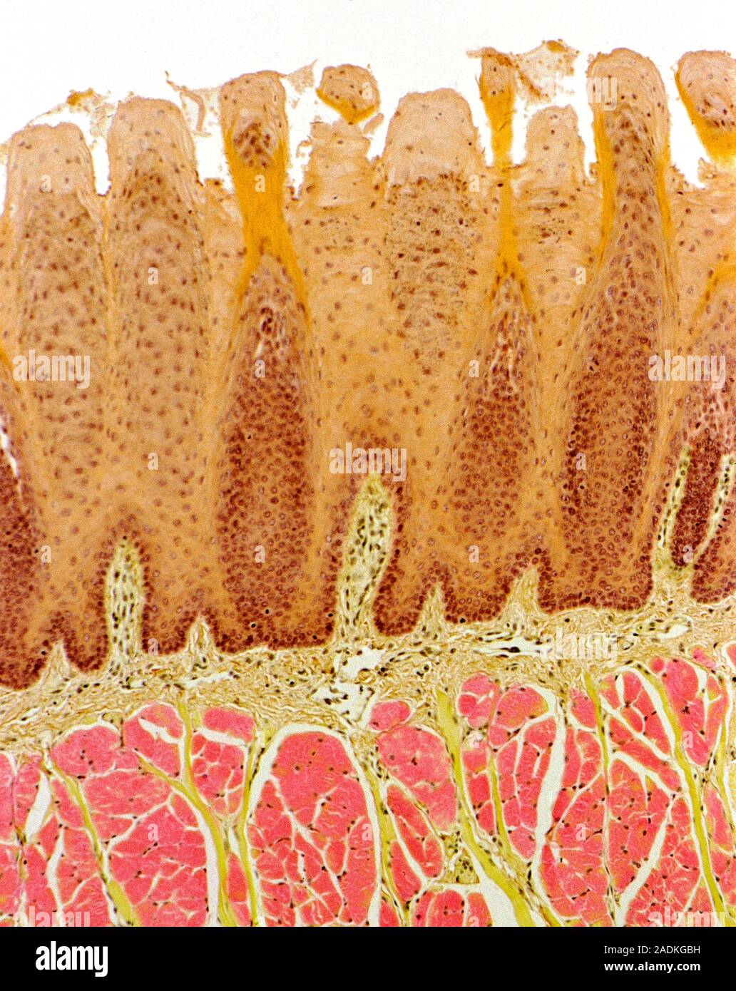 Tongue papillae. Coloured light micrograph of a section through the ...