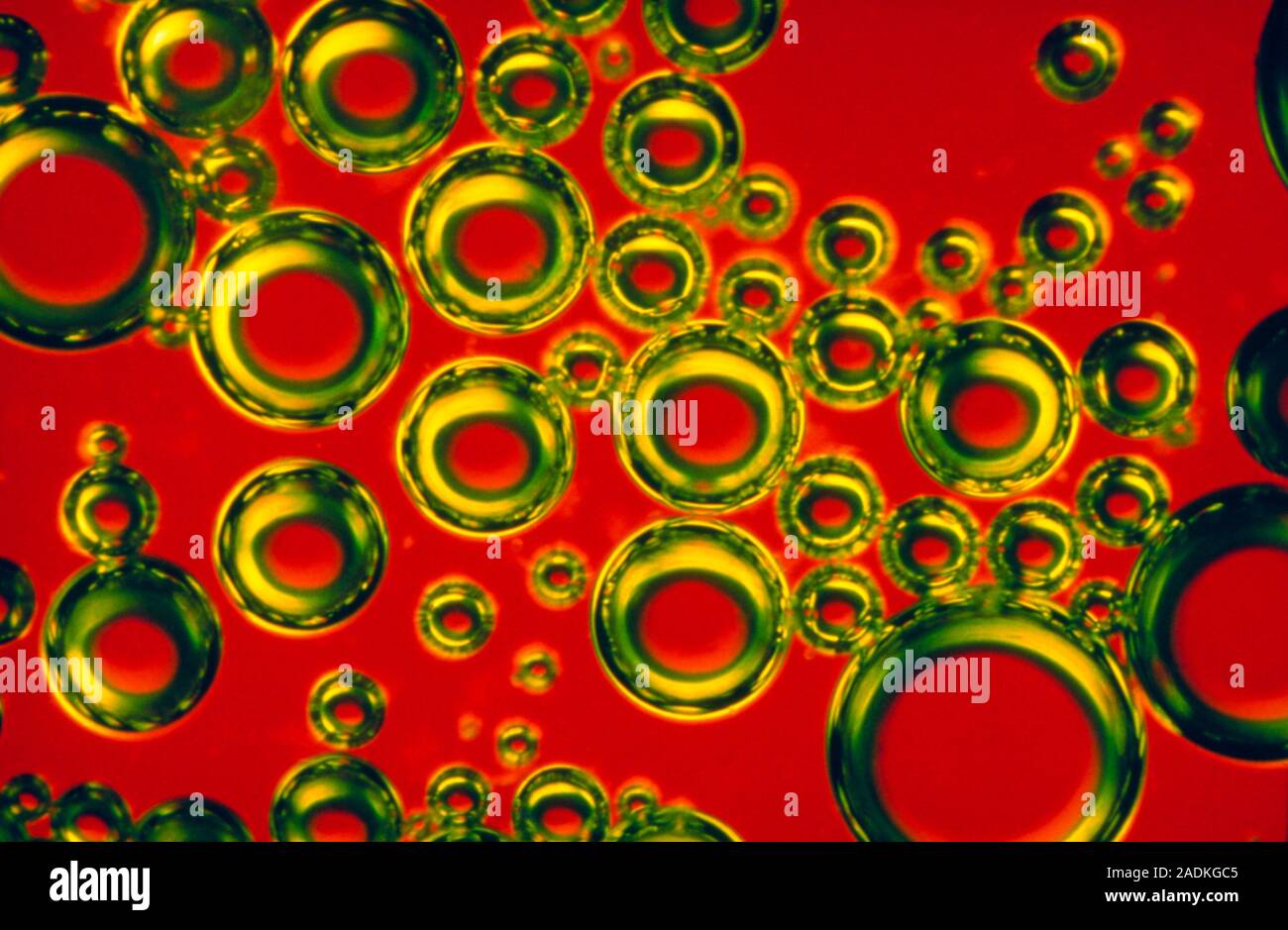 Light micrograph of bubbles of human saliva. Magnification: x100 at ...