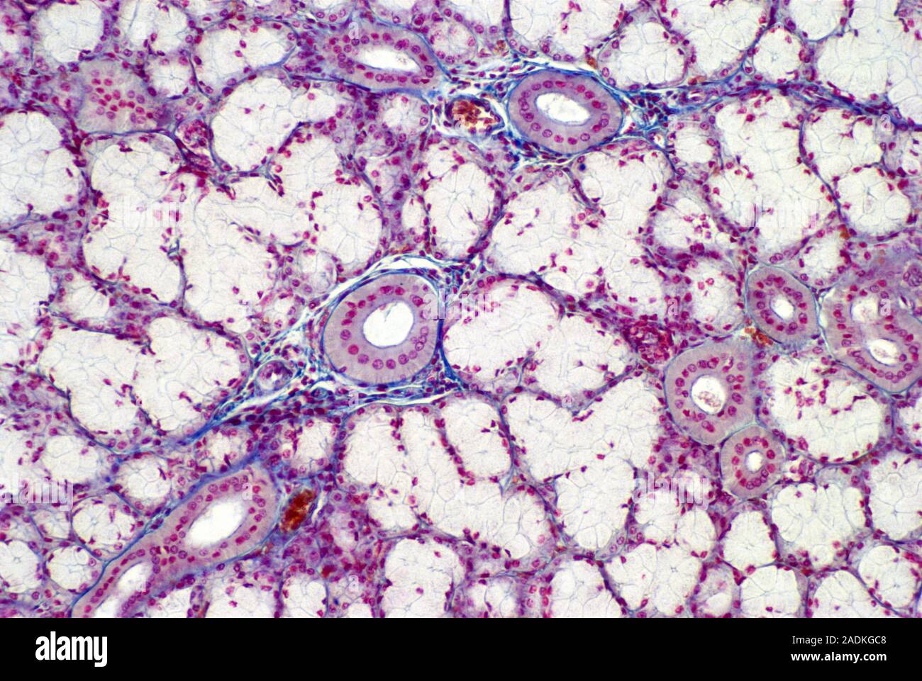 Light micrograph of normal human parotid gland. One of the salivary ...
