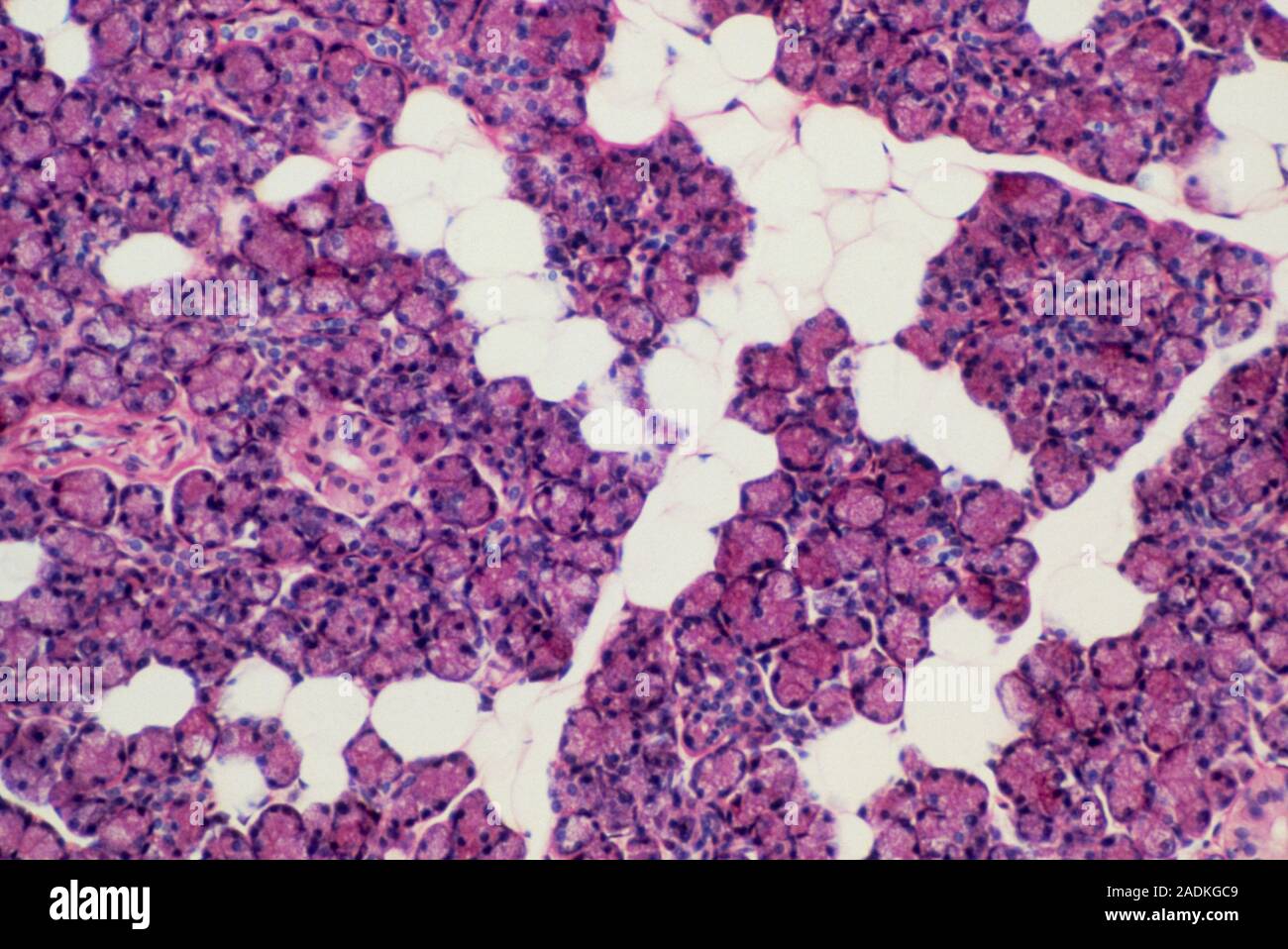 Light micrograph of normal human parotid gland. One of the salivary ...