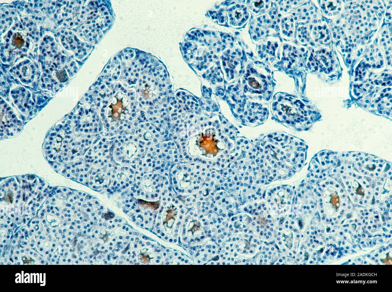 Parotid gland. Light micrograph of a section through a normal human ...