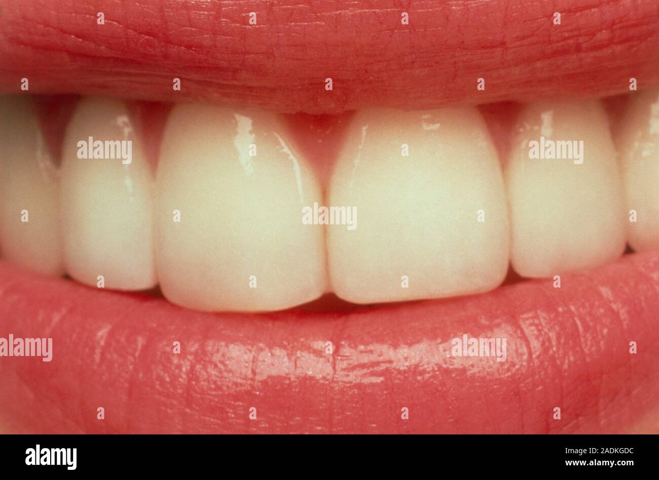 Teeth. Close-up of a woman's mouth (seen in front view), showing ...