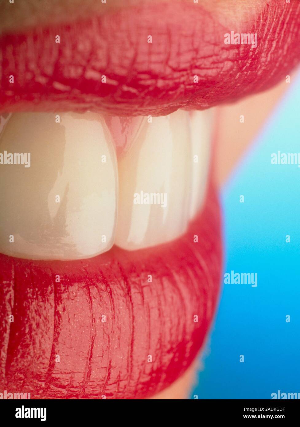 Teeth. Close-up of a woman's smiling mouth (seen in side view), showing ...