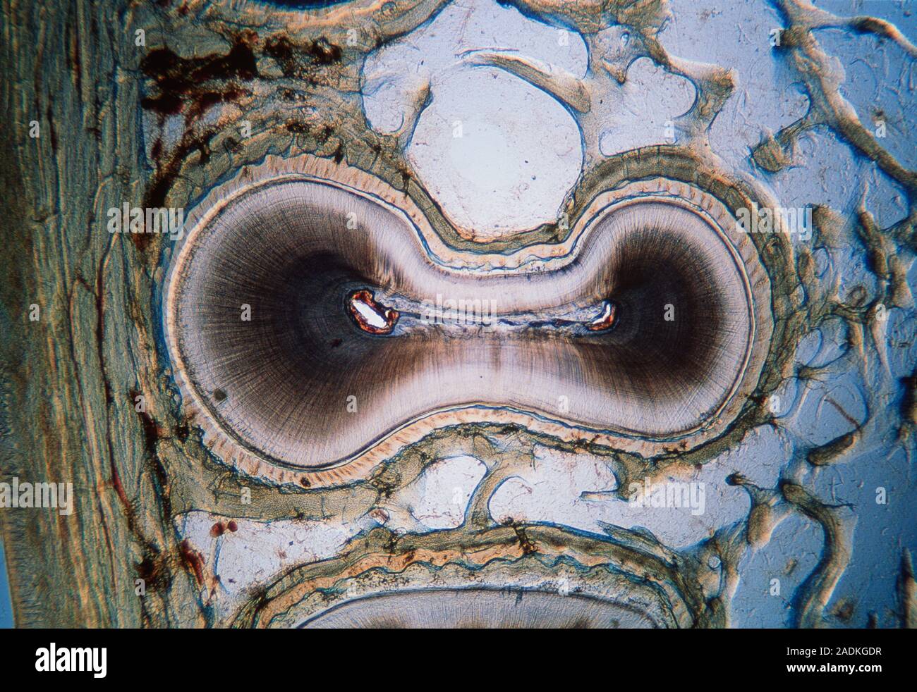 Tooth root. Light micrograph of a horizontal section through a molar ...
