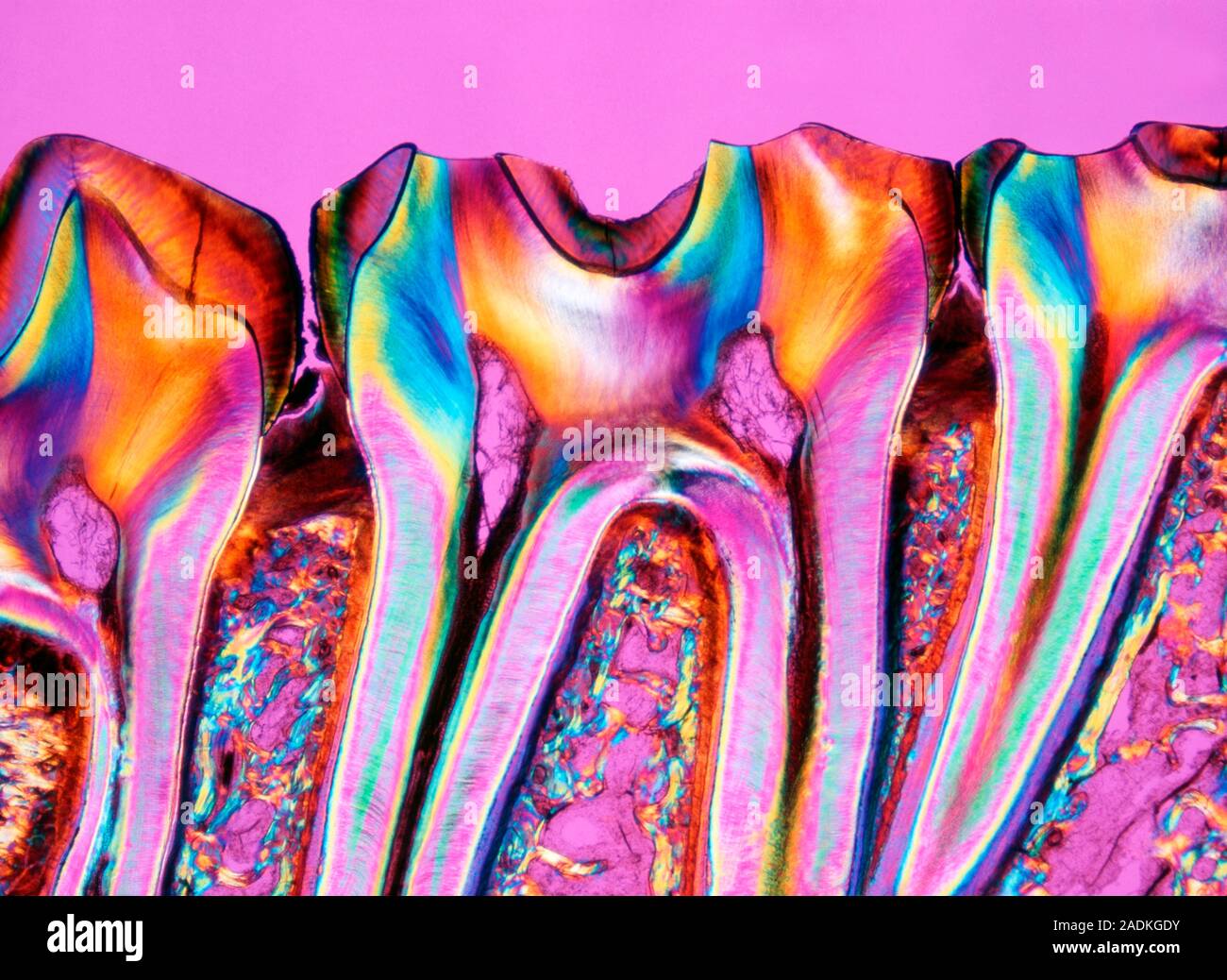 Molar teeth. Polarised light micrograph (PLM) of a section through ...
