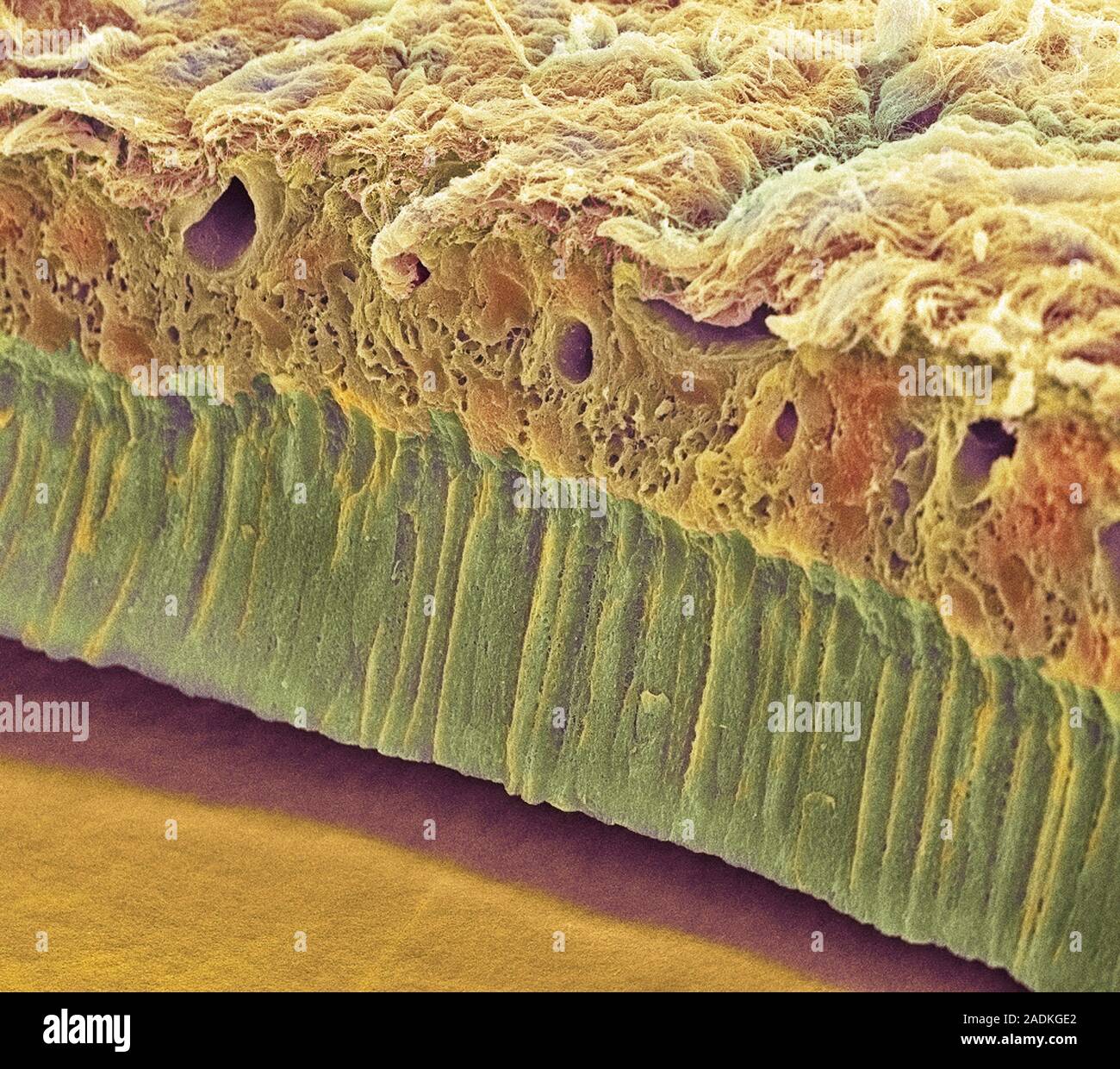 Tooth enamel formation. Coloured scanning electron micrograph (SEM) of ...
