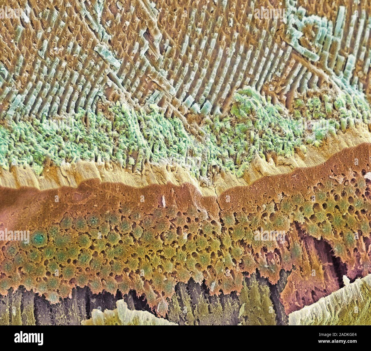 Tooth enamel formation. Coloured scanning electron micrograph (SEM) of a freeze-fractured ...