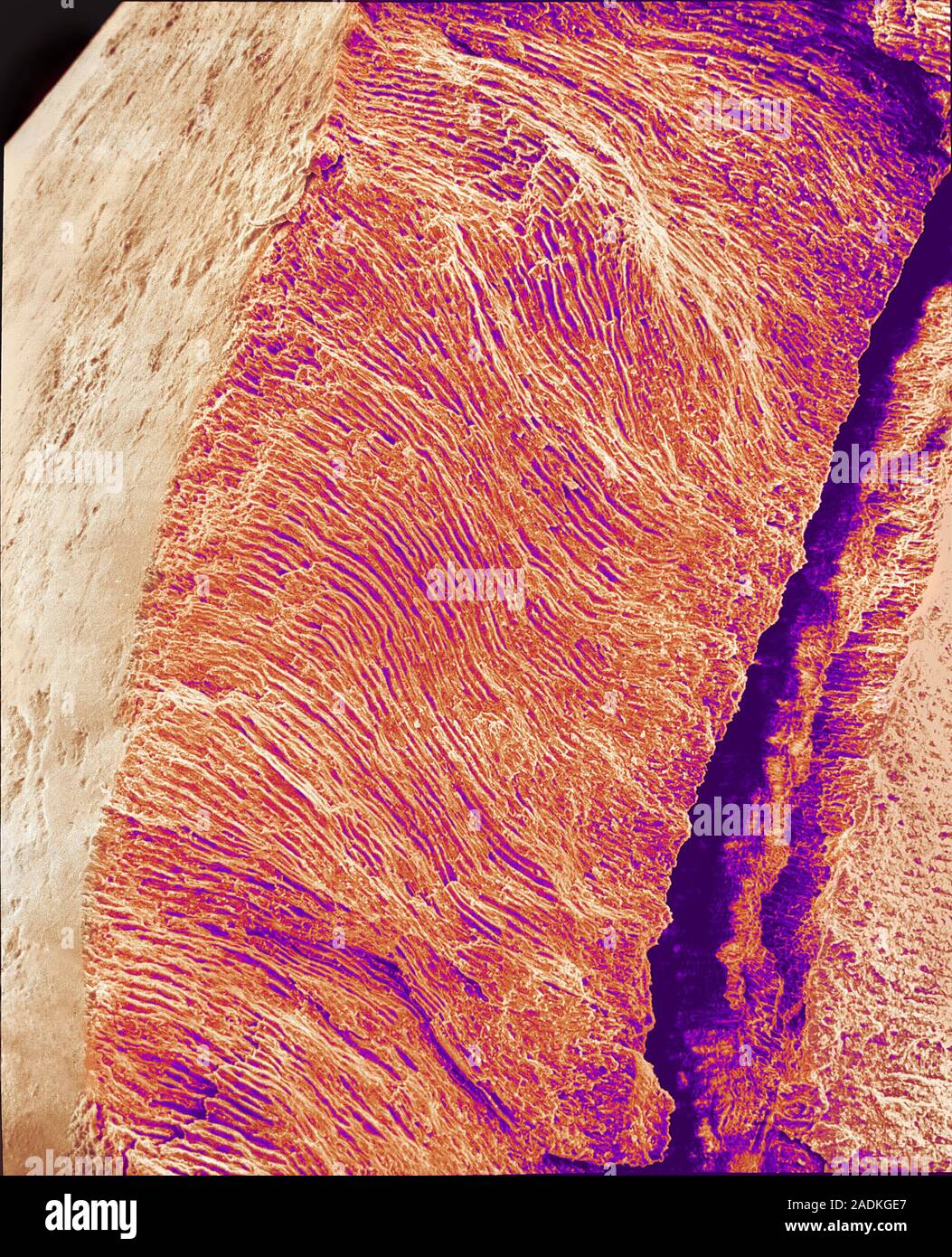 Tooth dentine. Coloured scanning electron micrograph (SEM) of a section ...