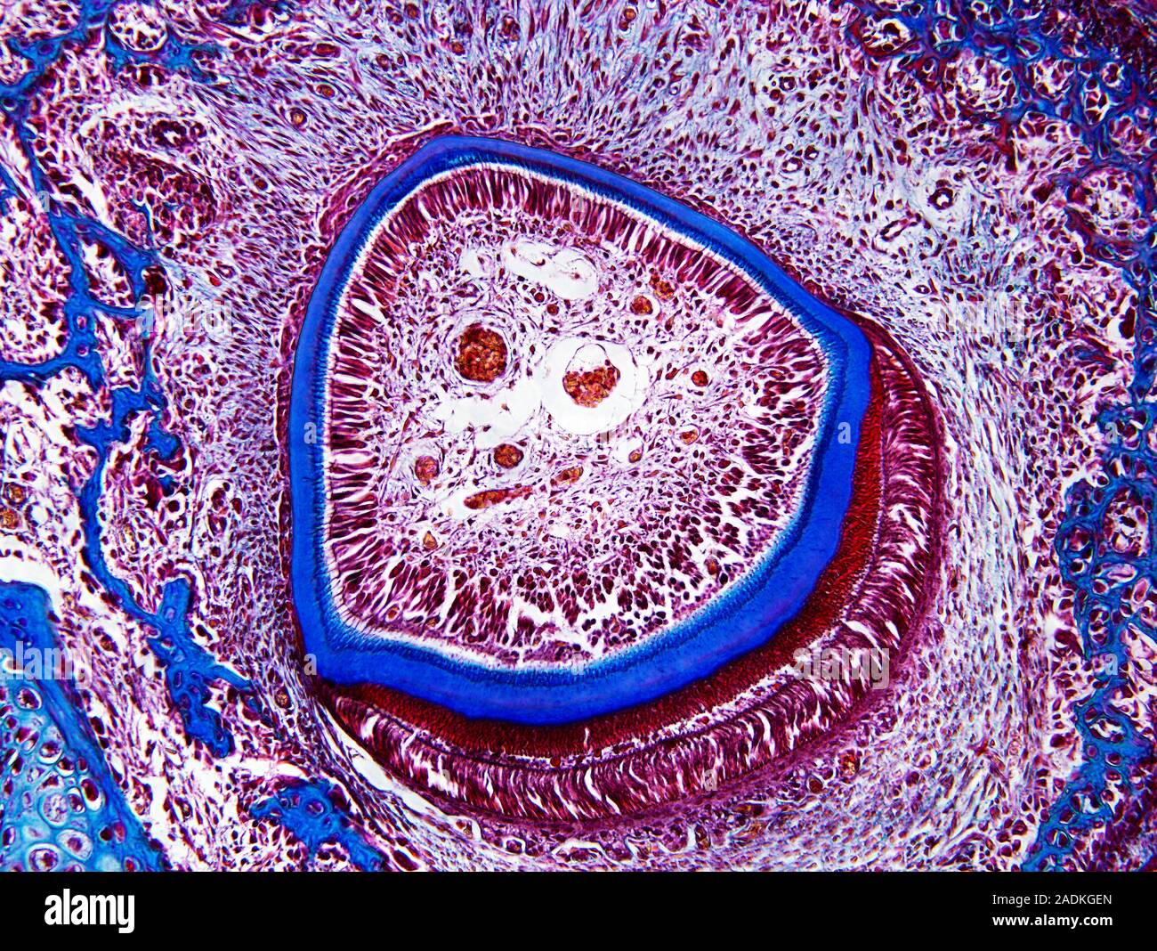 Tooth. Coloured light micrograph (LM) of an axial section through an ...