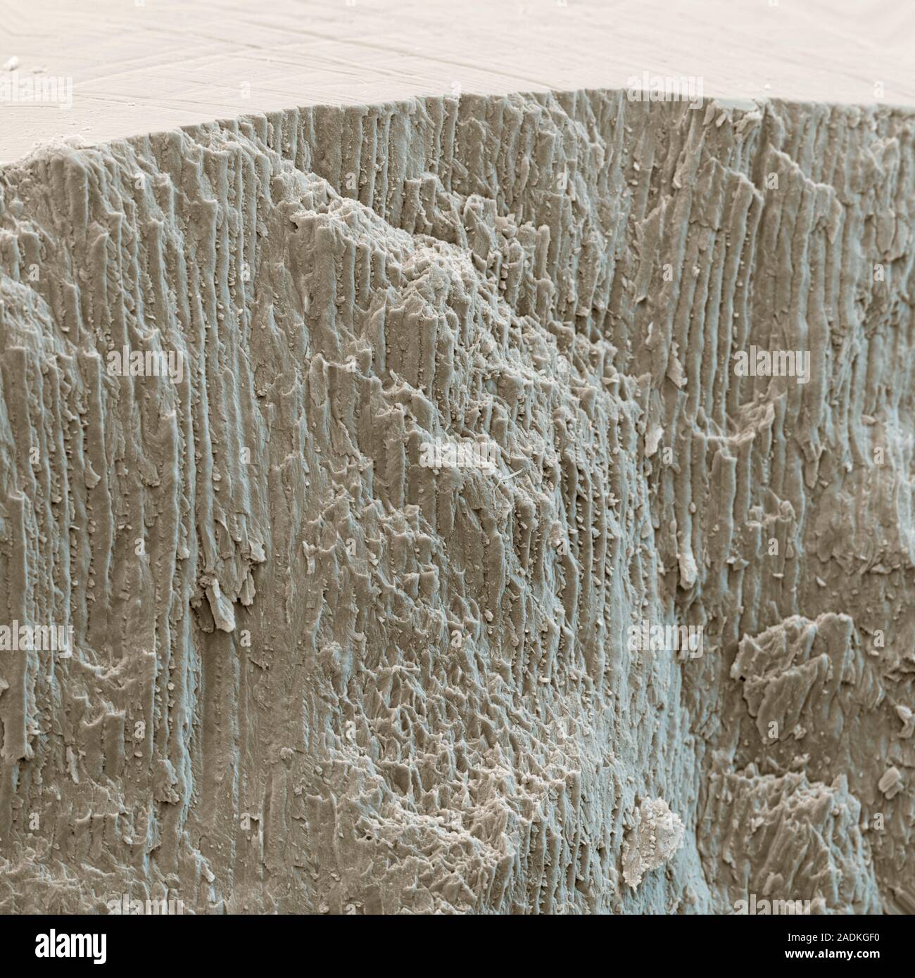 Tooth enamel. Coloured scanning electron micrograph (SEM) of a section ...