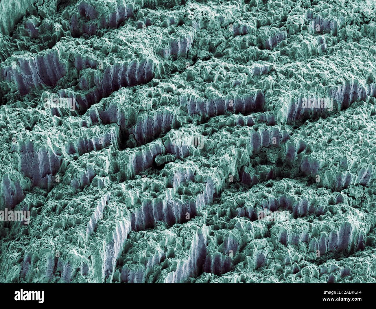 Tooth enamel. Coloured scanning electron micrograph (SEM) of a freeze ...