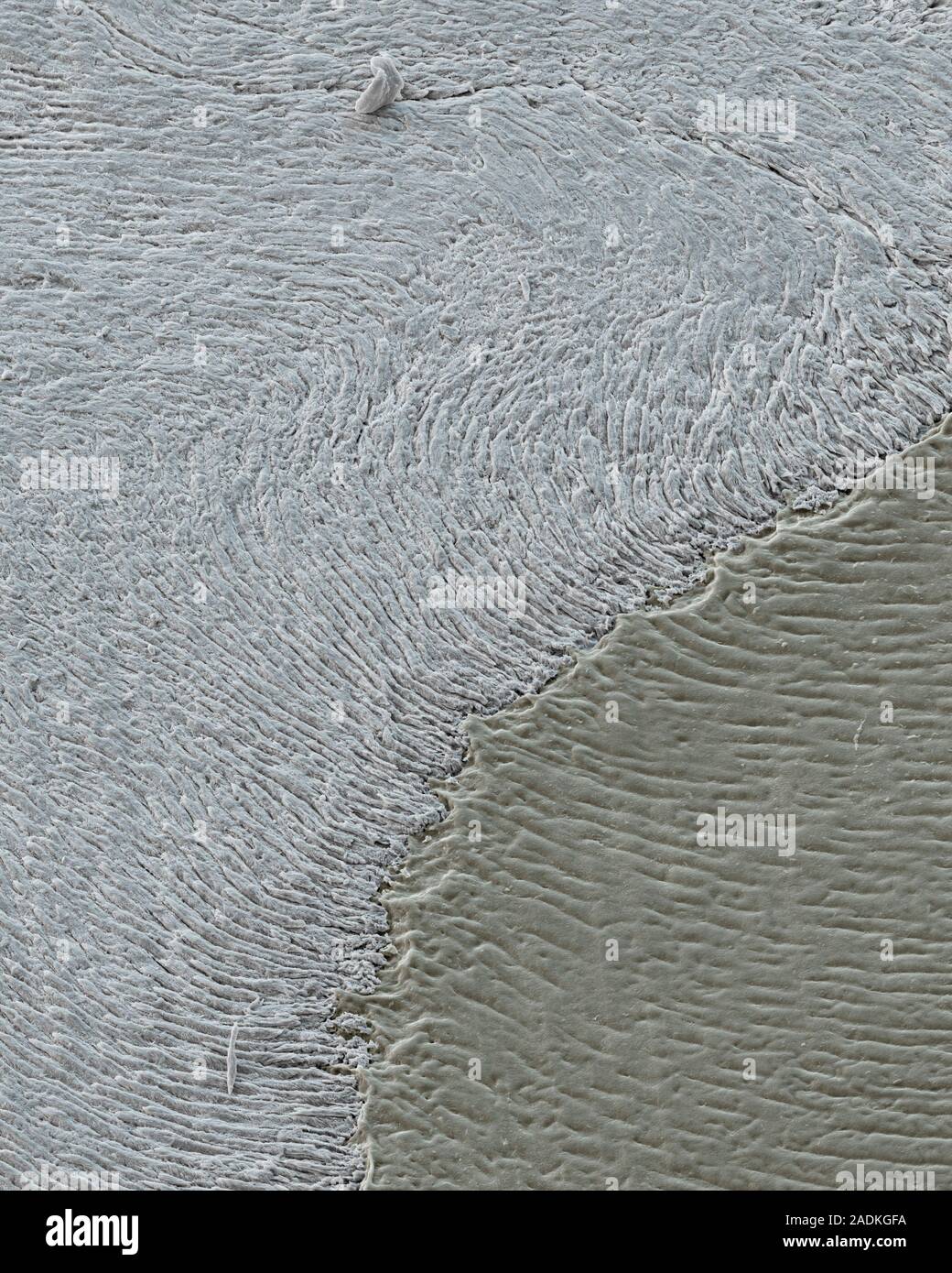 Tooth tissue. Coloured scanning electron micrograph (SEM) of tooth ...