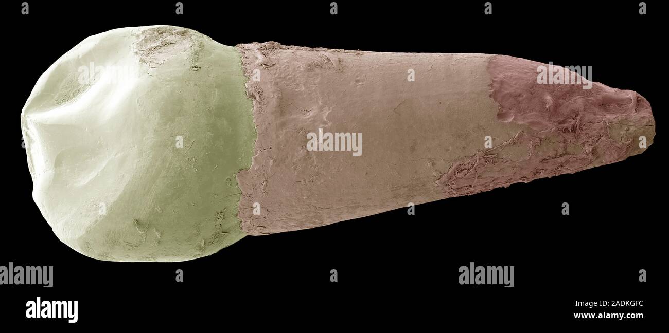 Milk tooth. Coloured scanning electron micrograph (SEM) of a human ...
