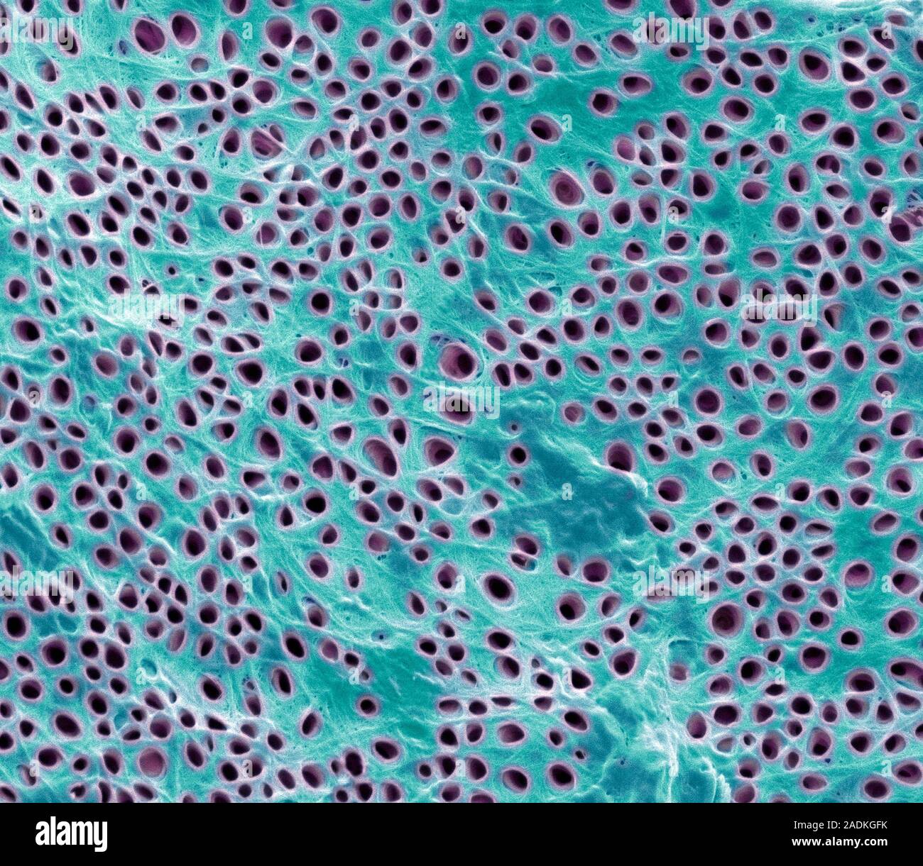 Tooth dentine. Coloured scanning electron micrograph (SEM) of dentine ...
