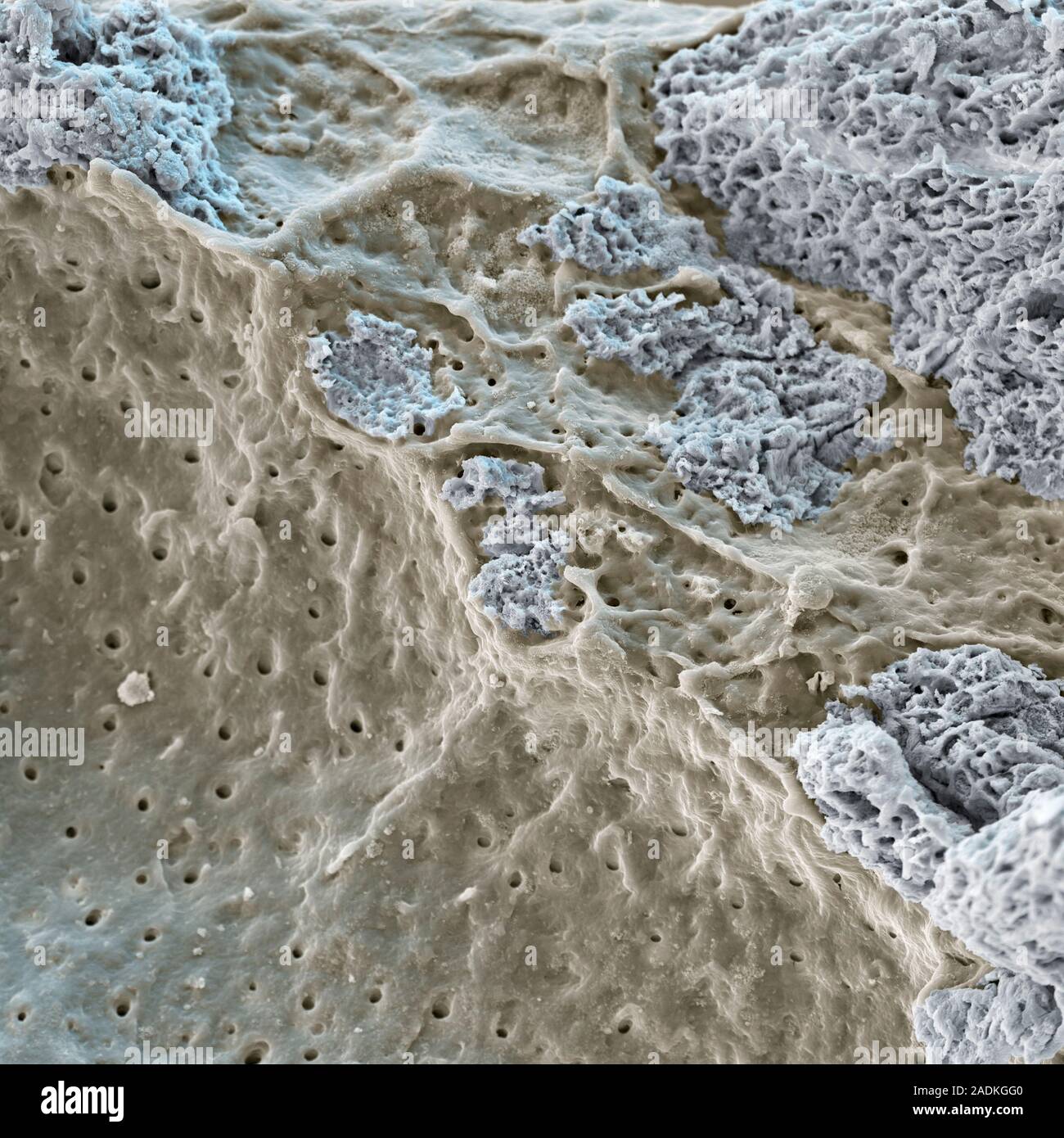 Tooth tissue. Coloured scanning electron micrograph (SEM) of the ...