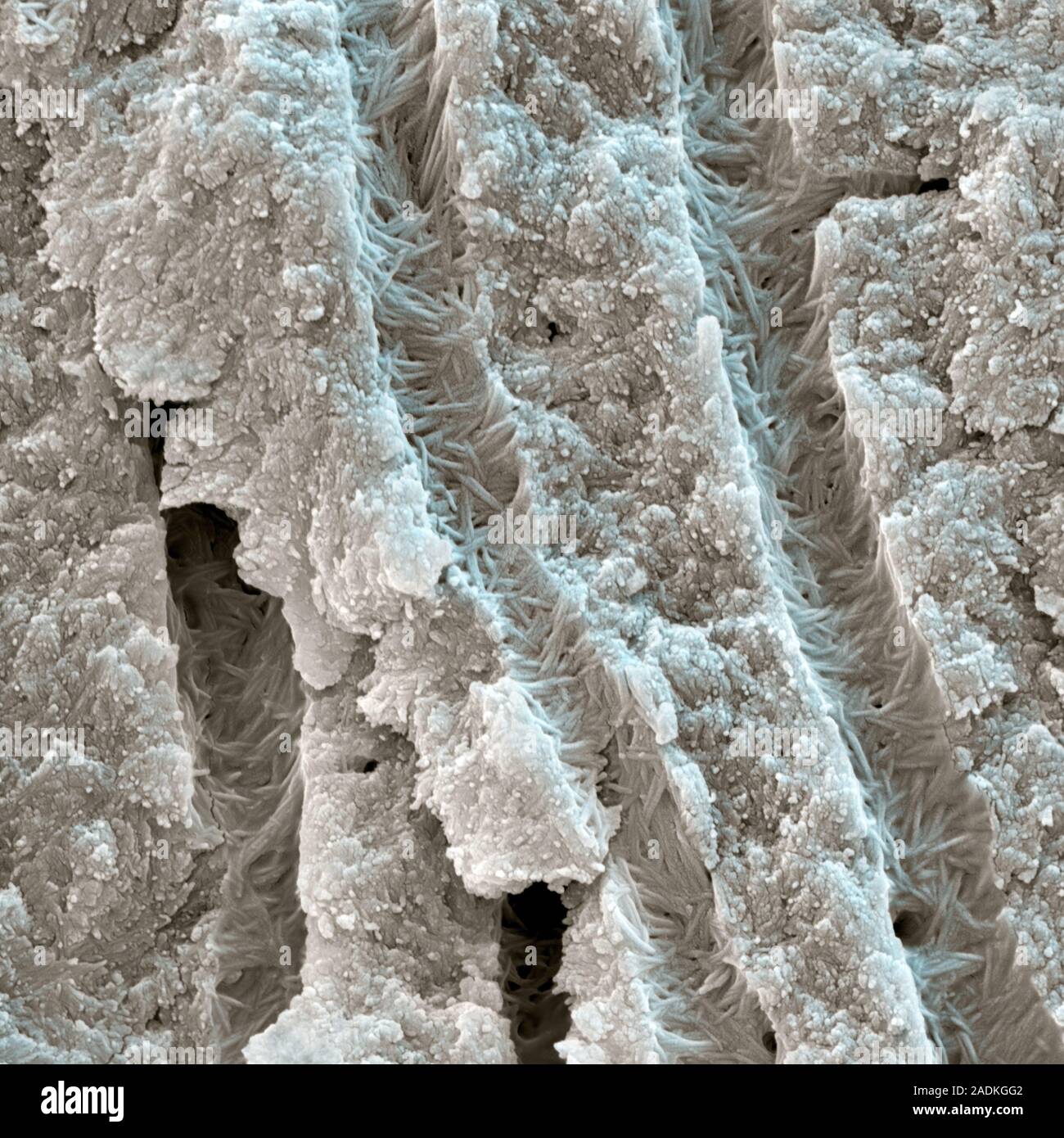 Dentine tooth tissue. Coloured scanning electron micrograph (SEM) of ...