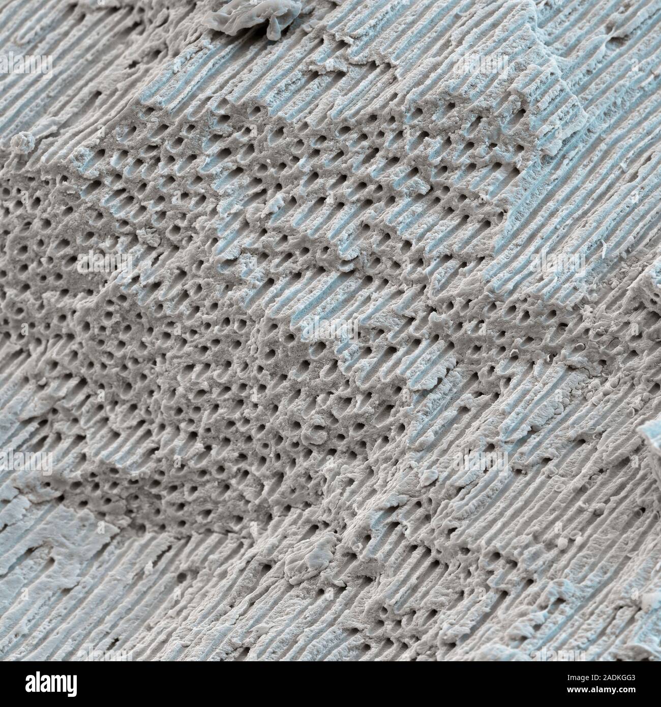 Dentine tooth tissue. Coloured scanning electron micrograph (SEM) of ...