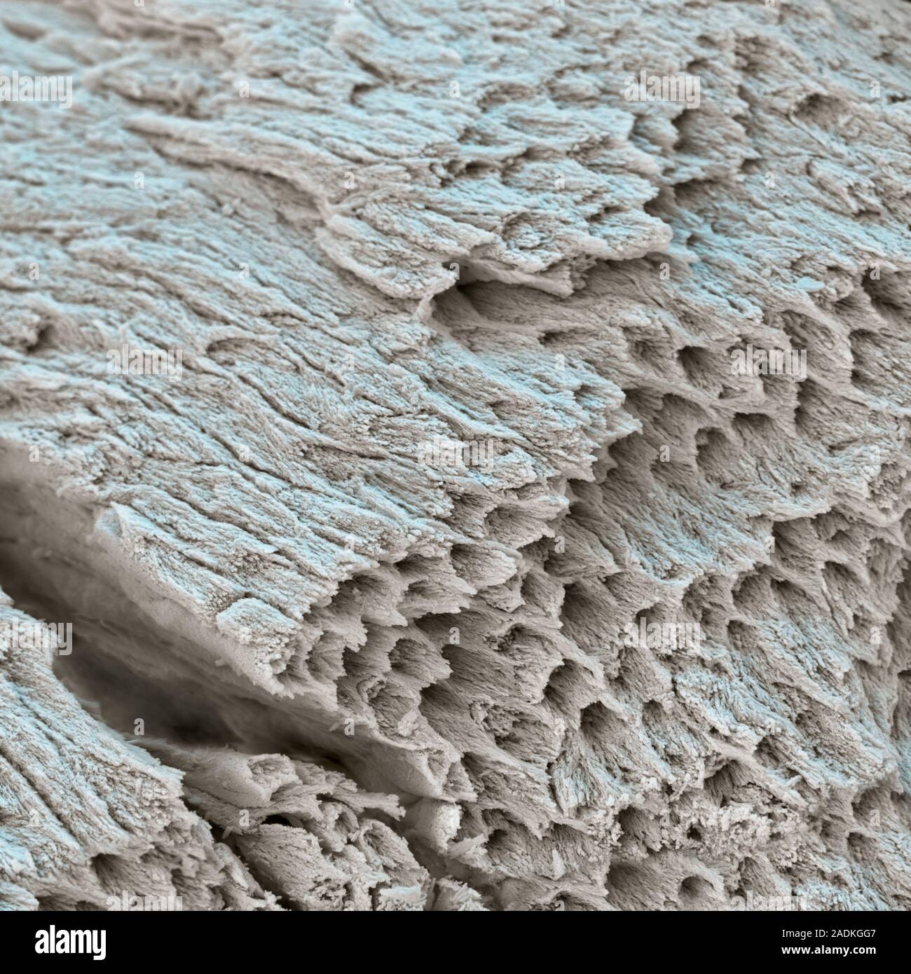 Tooth enamel. Coloured scanning electron micrograph (SEM) of a section ...