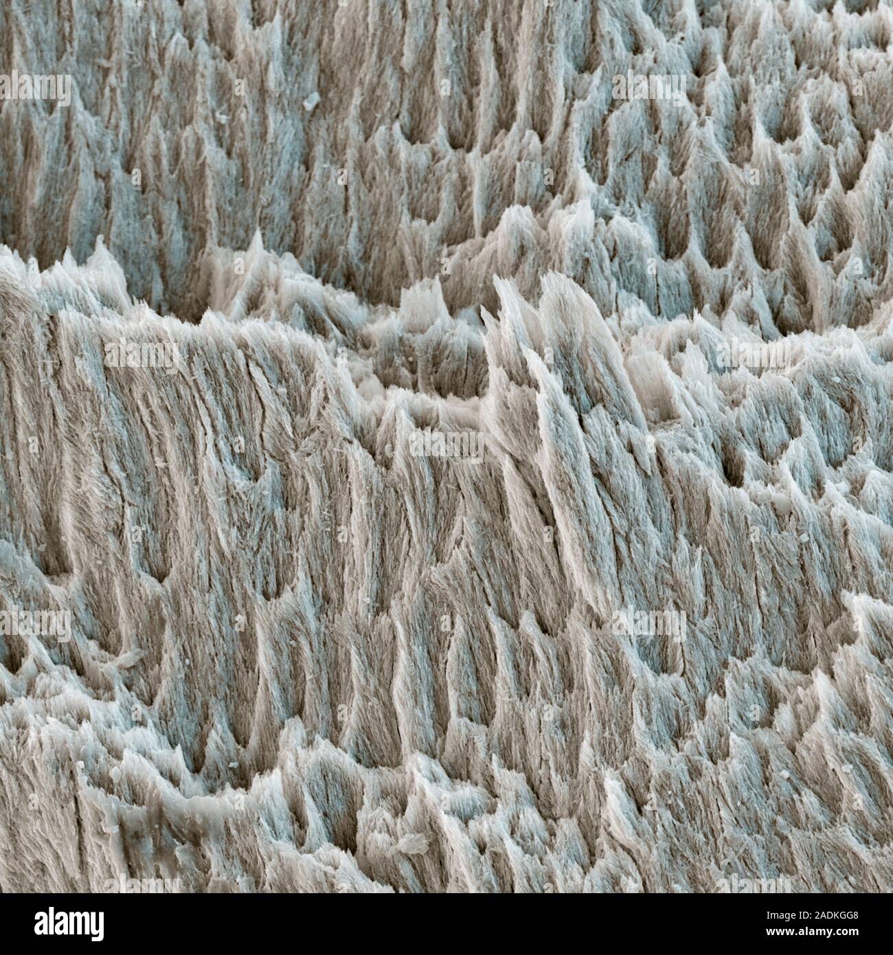 Tooth enamel. Coloured scanning electron micrograph (SEM) of a section ...