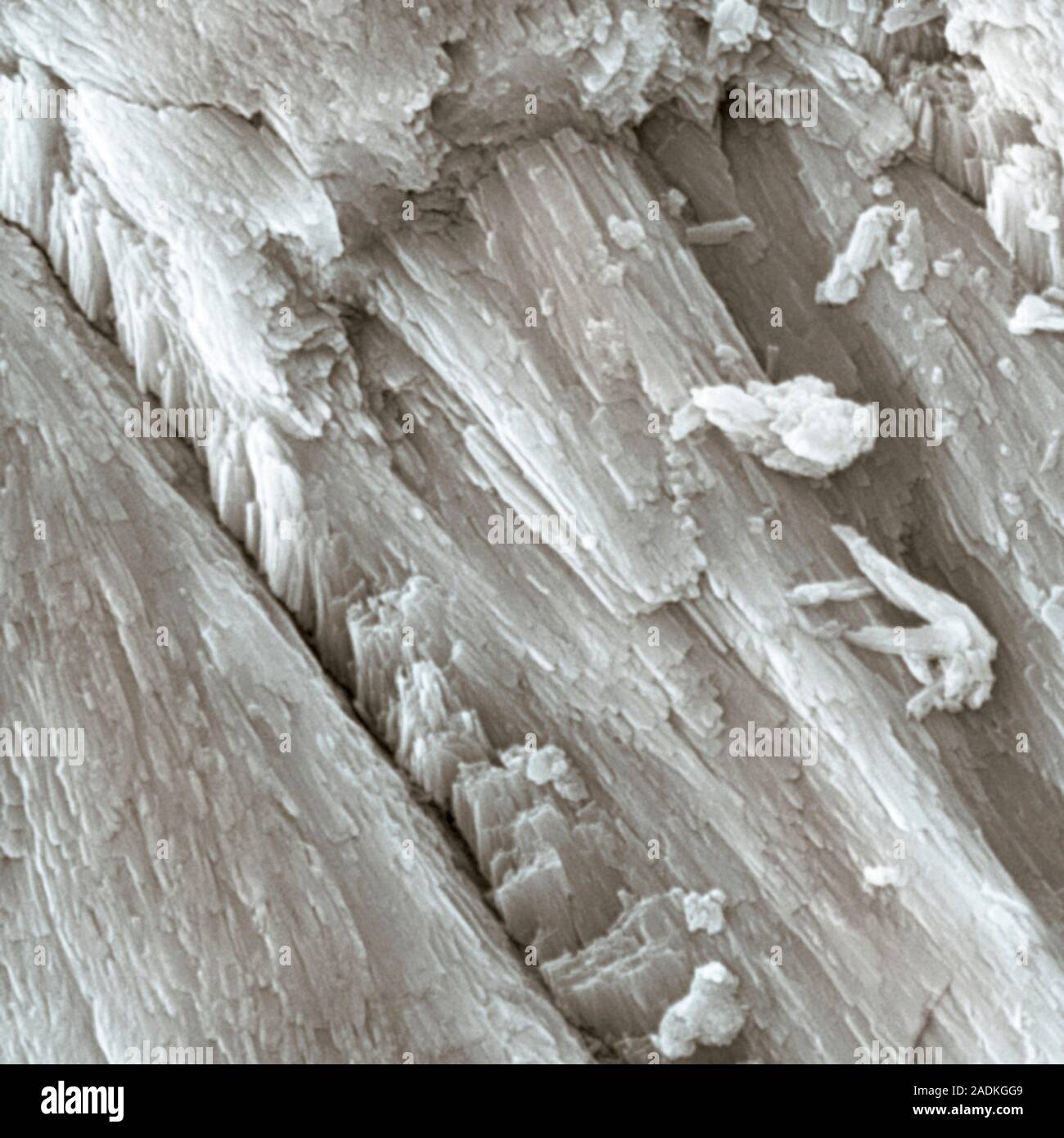 Tooth enamel. Coloured scanning electron micrograph (SEM) of a section ...