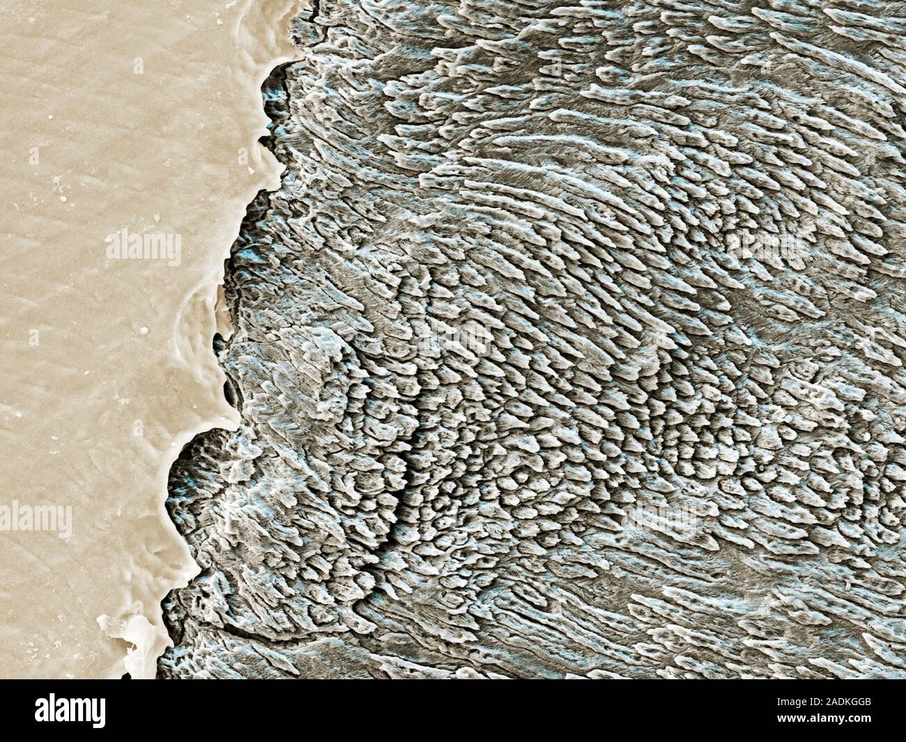 Tooth tissue. Coloured scanning electron micrograph (SEM) of the ...