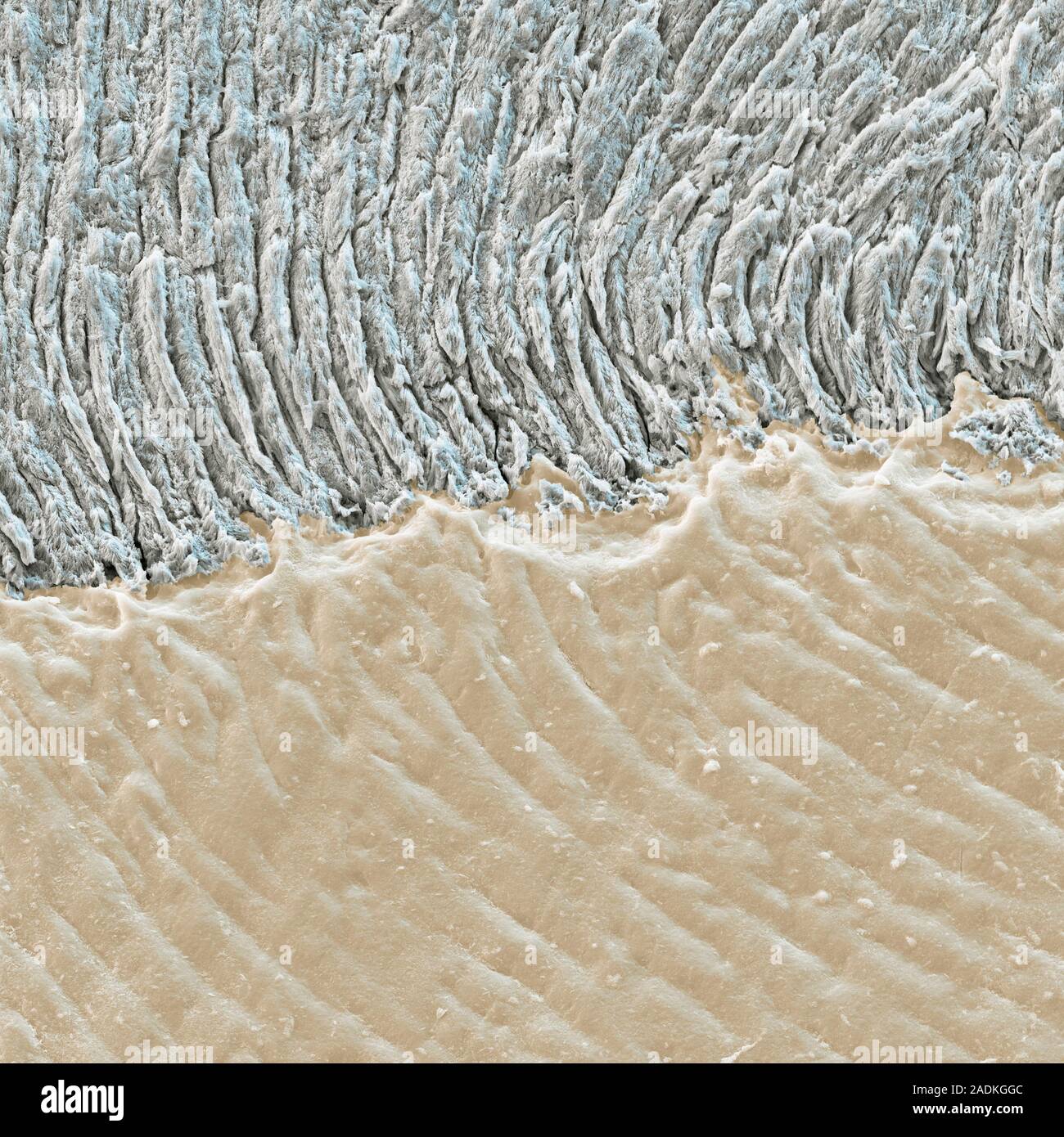 Tooth tissue. Coloured scanning electron micrograph (SEM) of the ...