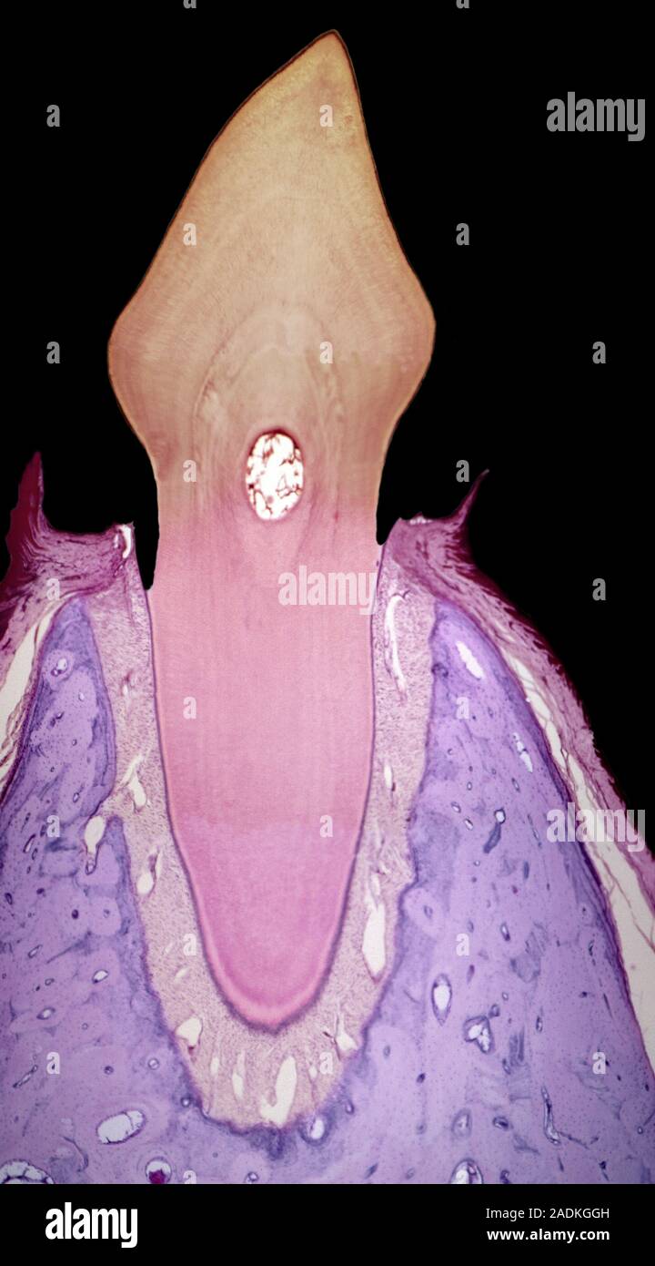 Incisor tooth. Light micrograph of a section through an incisor ...