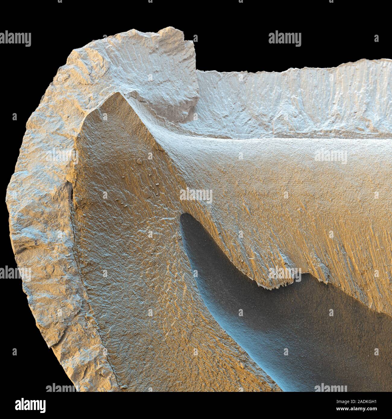 Tooth structure. Coloured scanning electron micrograph (SEM) of a ...
