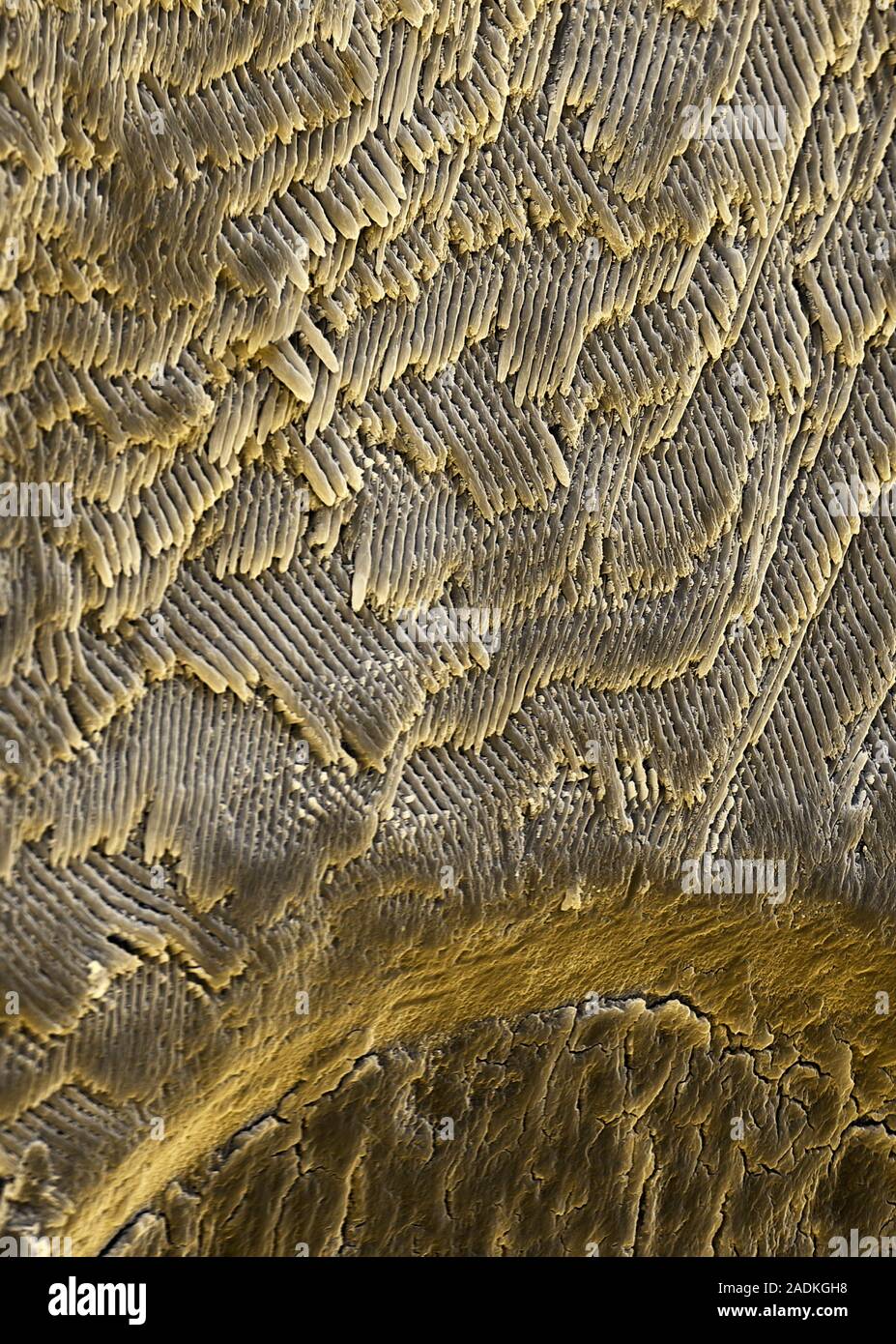 Dentine tooth tissue (substantia eburnea), coloured scanning electron ...