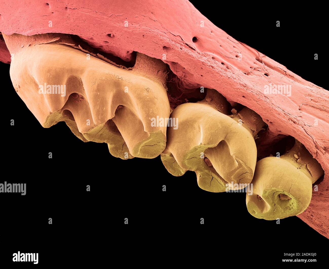 Mouse molars. Coloured scanning electron micrograph (SEM) of mouse (Mus ...