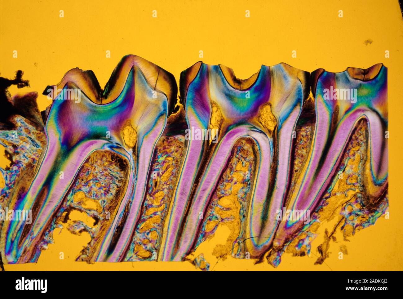 Primate molar teeth. Light micrograph of a section through three molar ...