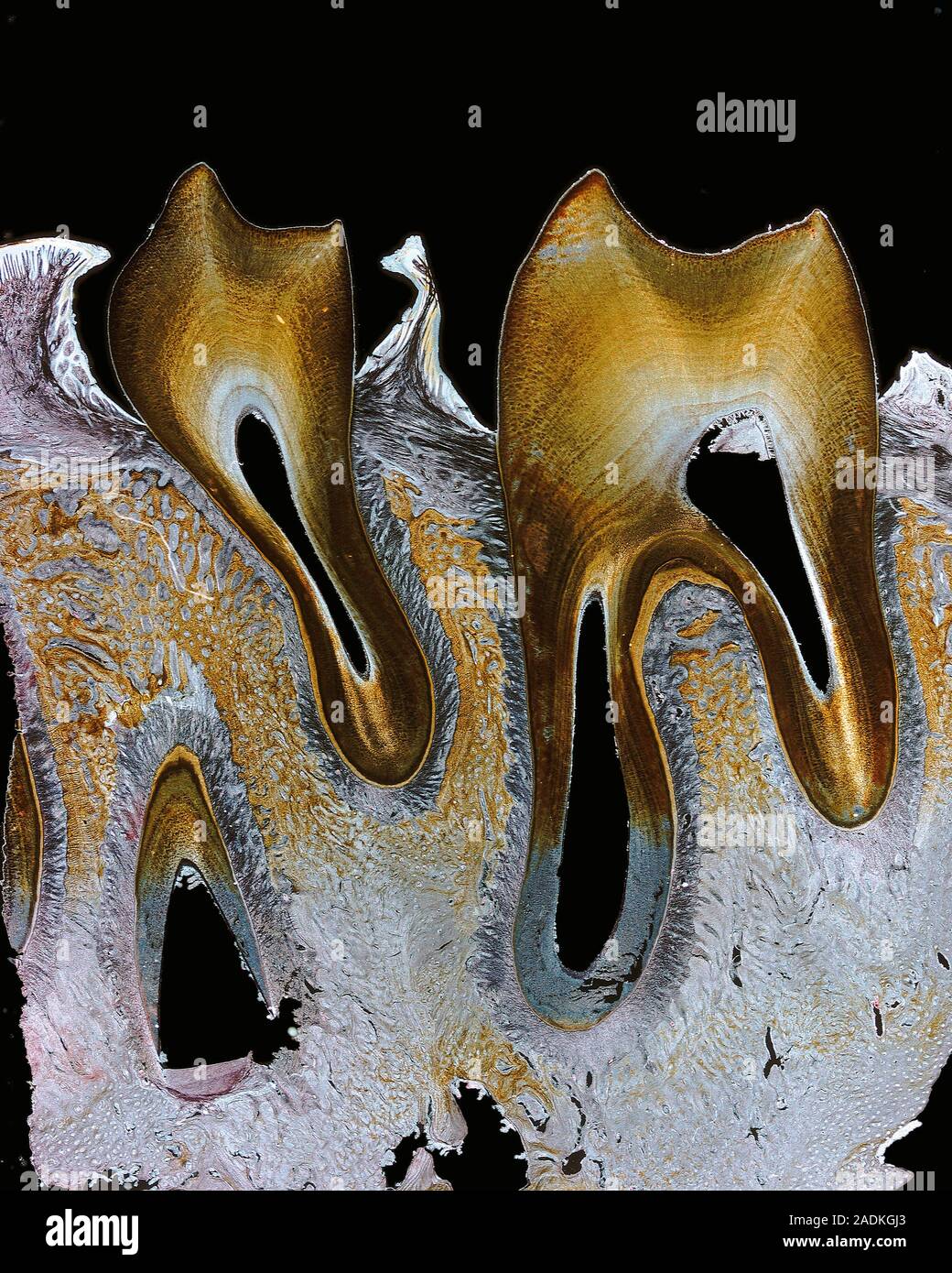 Ape teeth. Coloured scanning electron micrograph (SEM) of sections ...