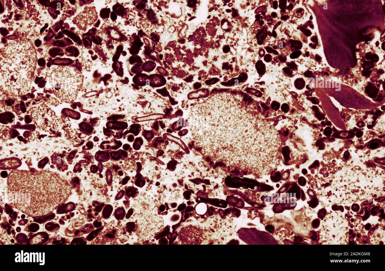 Human faeces. Coloured transmission electron micrograph (TEM) of human ...