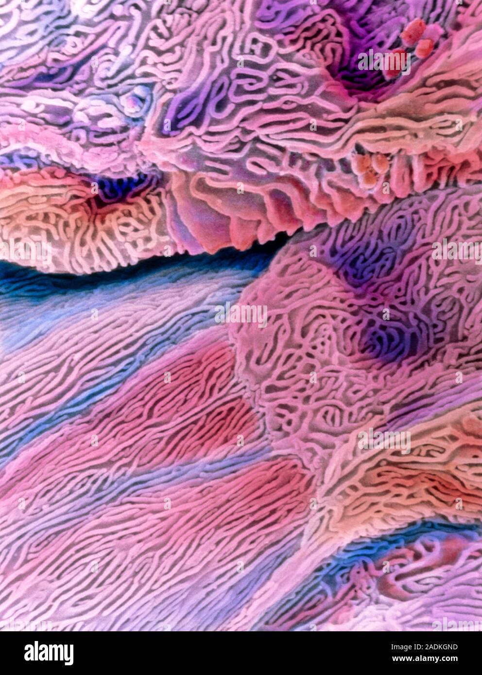 False-colour scanning electron micrograph (SEM) of the epithelium in ...