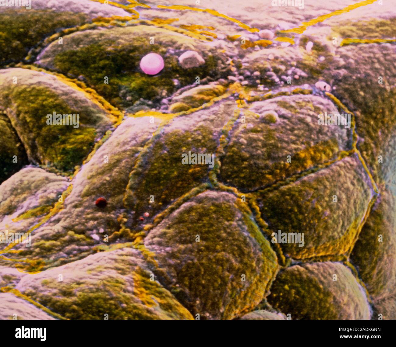 False-colour scanning electron micrograph (SEM) of the epithelium of ...