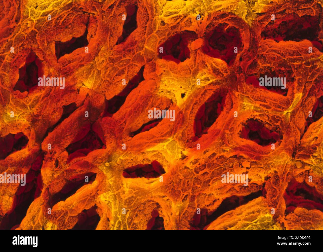 Stomach wall. Coloured Scanning Electron Micrograph (SEM) of the ...