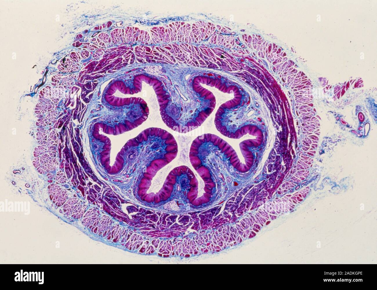 Oesophagus. Light micrograph of a cross-section through the human ...