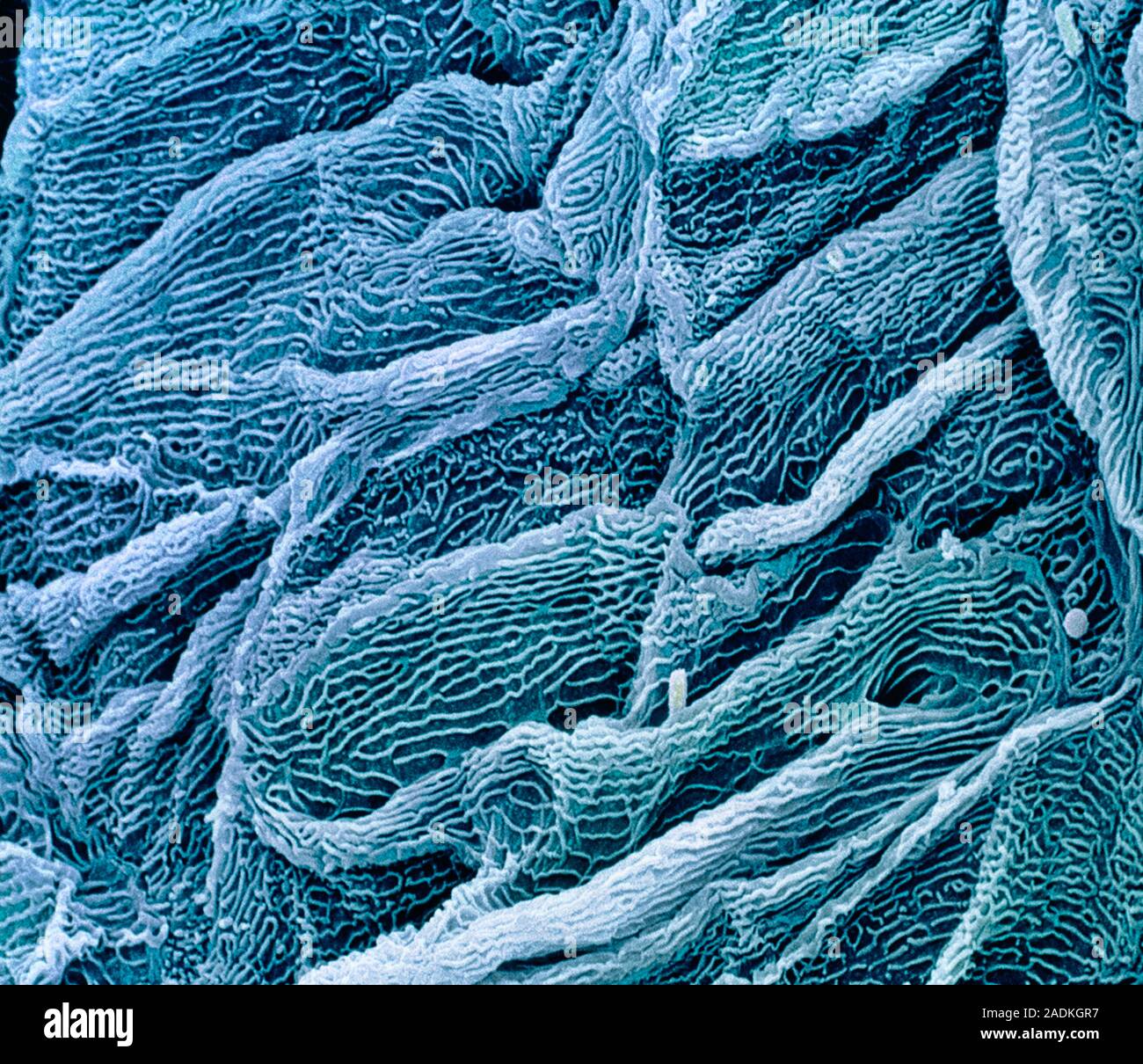 Oesophagus epithelium. Coloured scanning electron micrograph (SEM) of ...
