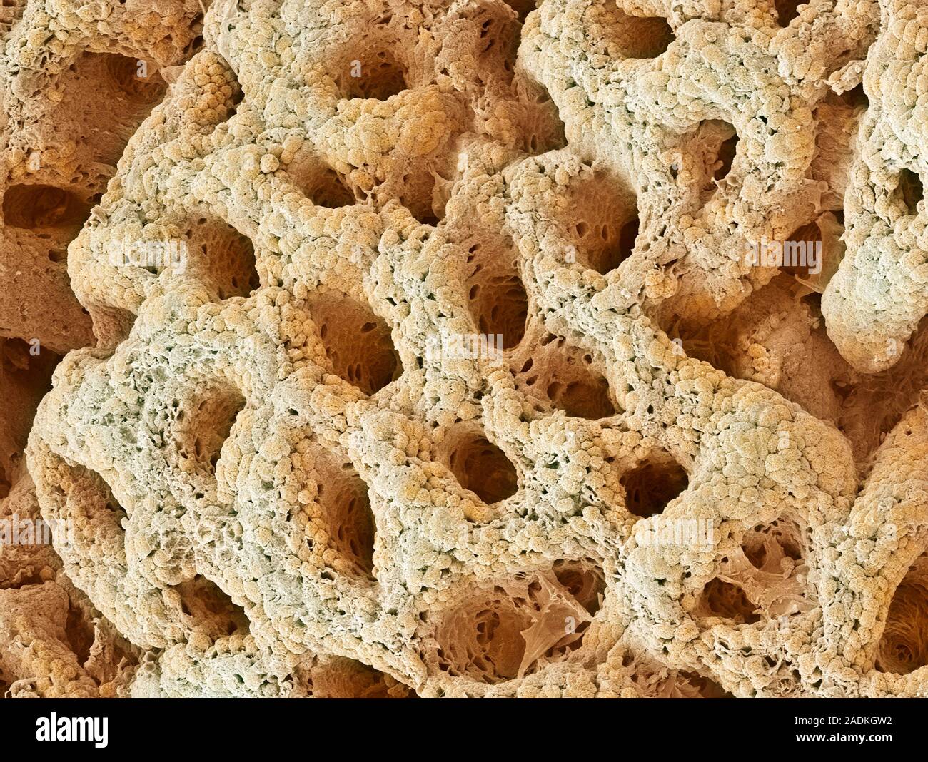 Stomach lining. Coloured scanning electron micrograph (SEM) of the ...