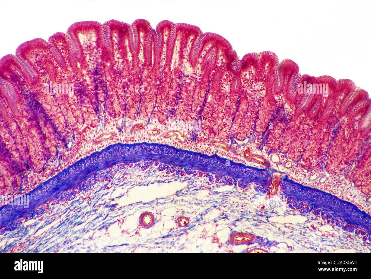 Stomach lining. Coloured light micrograph of the lining of the stomach ...