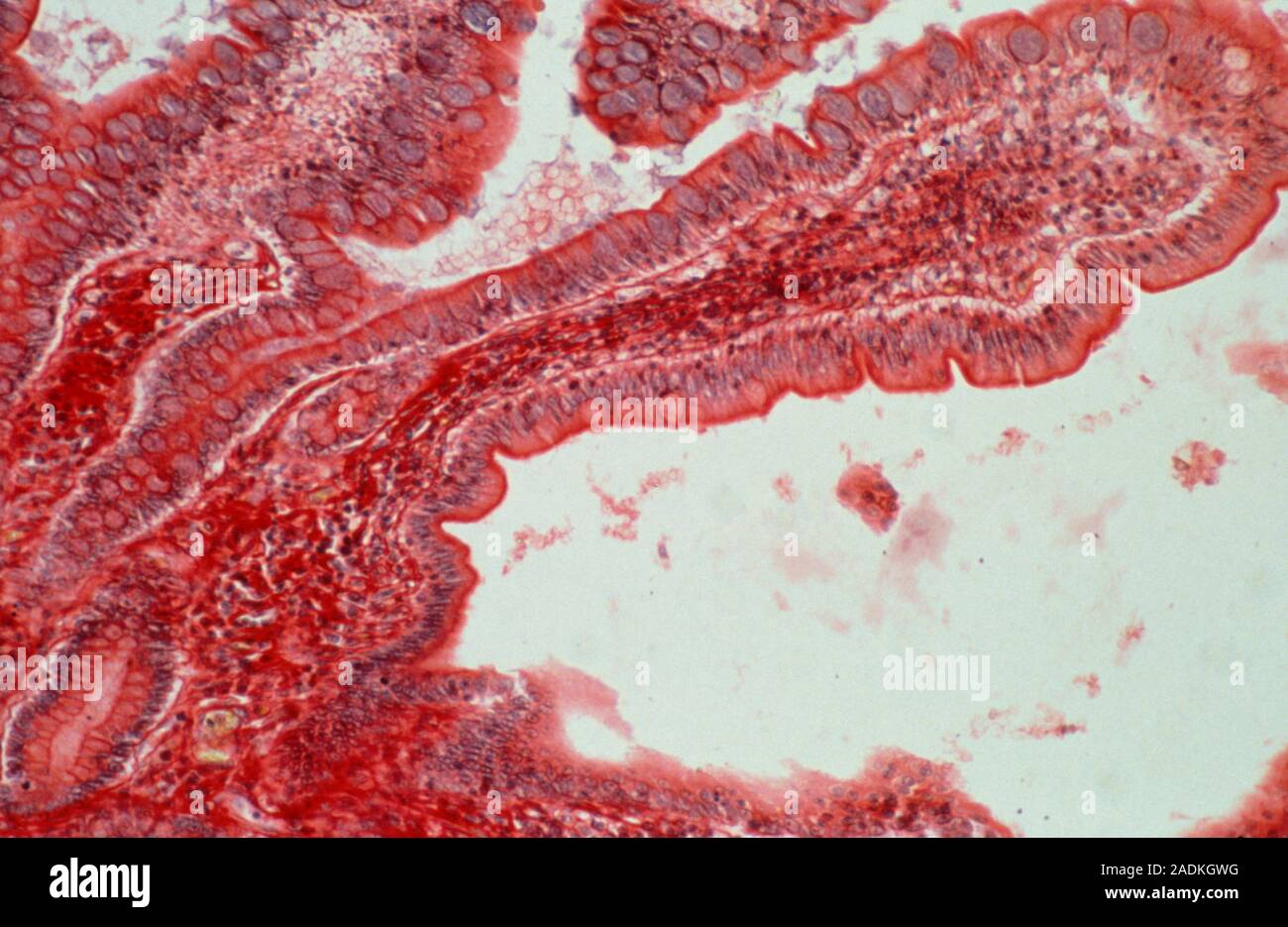 Light micrograph of villi in the normal human small intestine. Villi ...