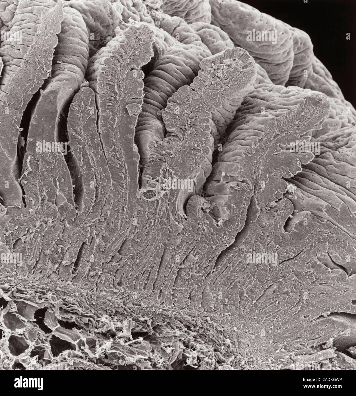 Scanning electron micrograph of a section through the wall of the human ...