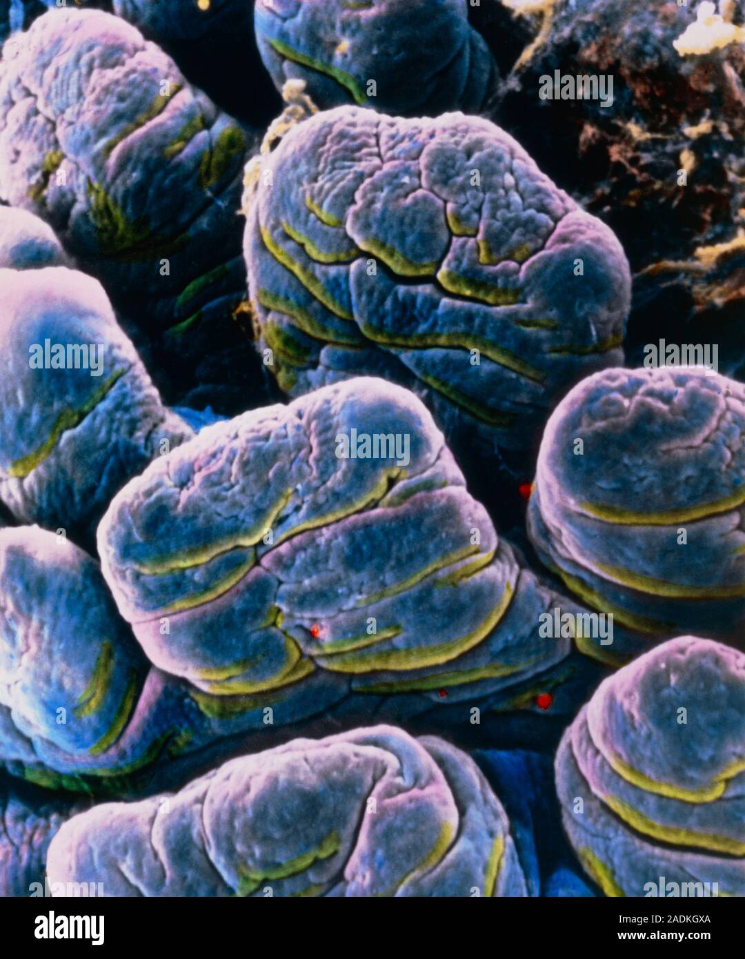 False-colour scanning electron micrograph (SEM) of intestinal villi in ...