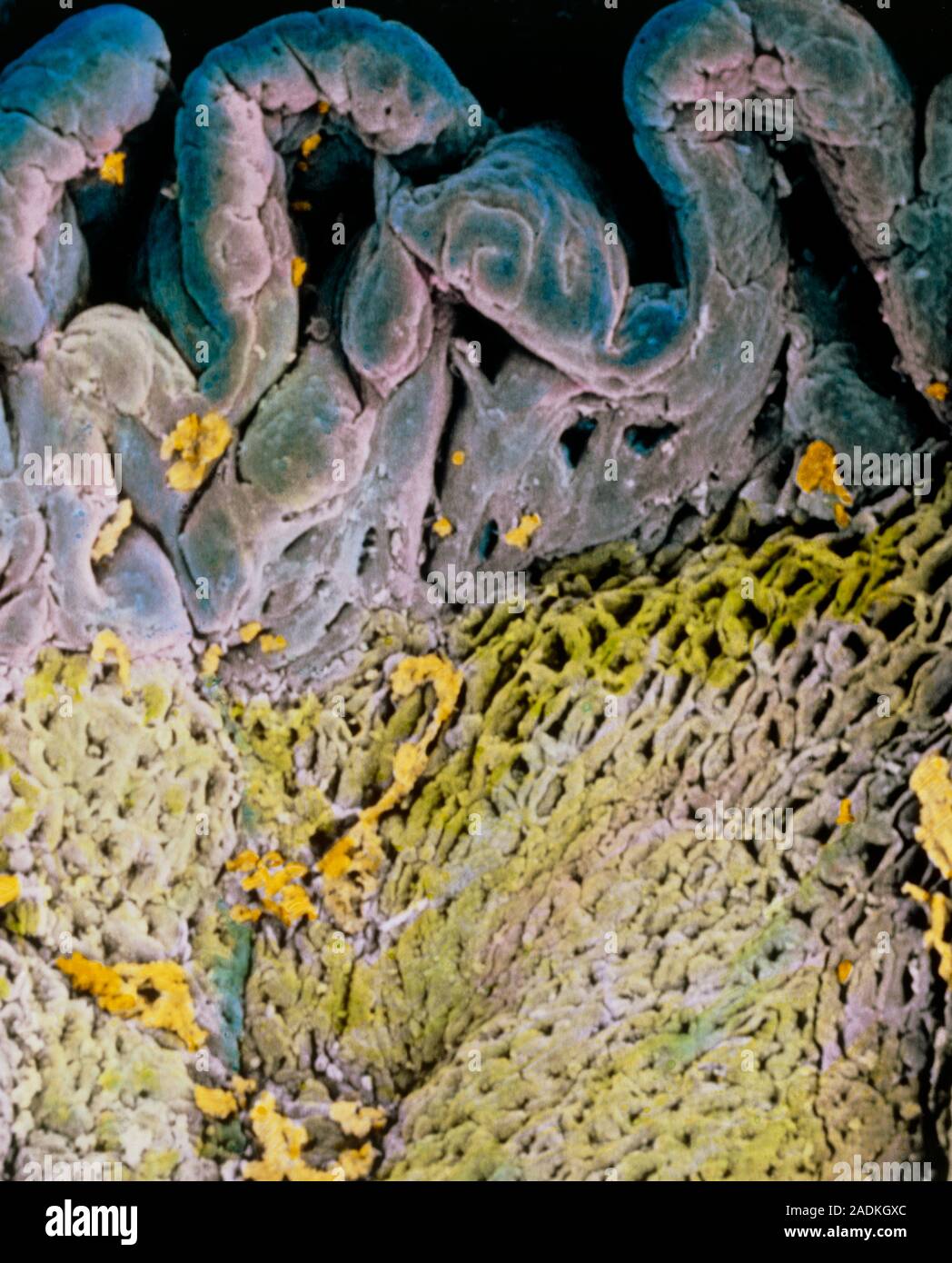 False-colour scanning electron micrograph (SEM) of the transition zone ...