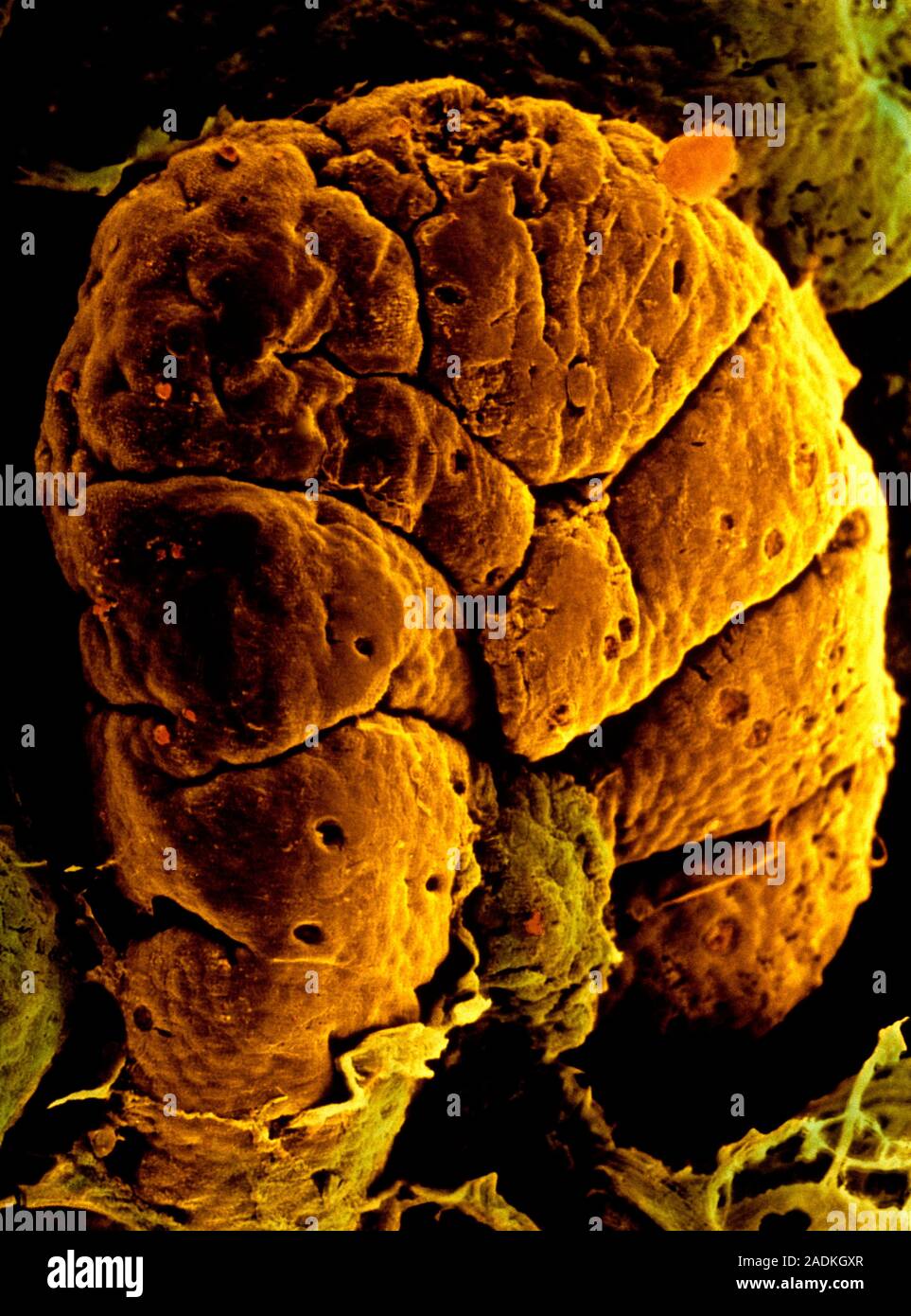 Villus. Coloured scanning electron micrograph of a villus in the small ...