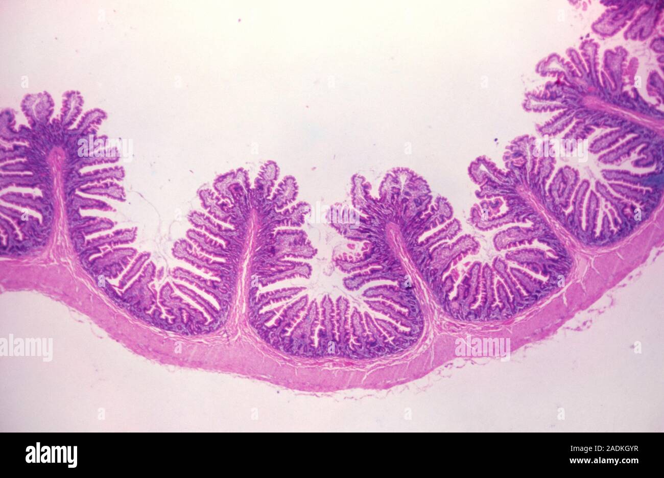 Small intestine. Light micrograph of a transverse section through the ...